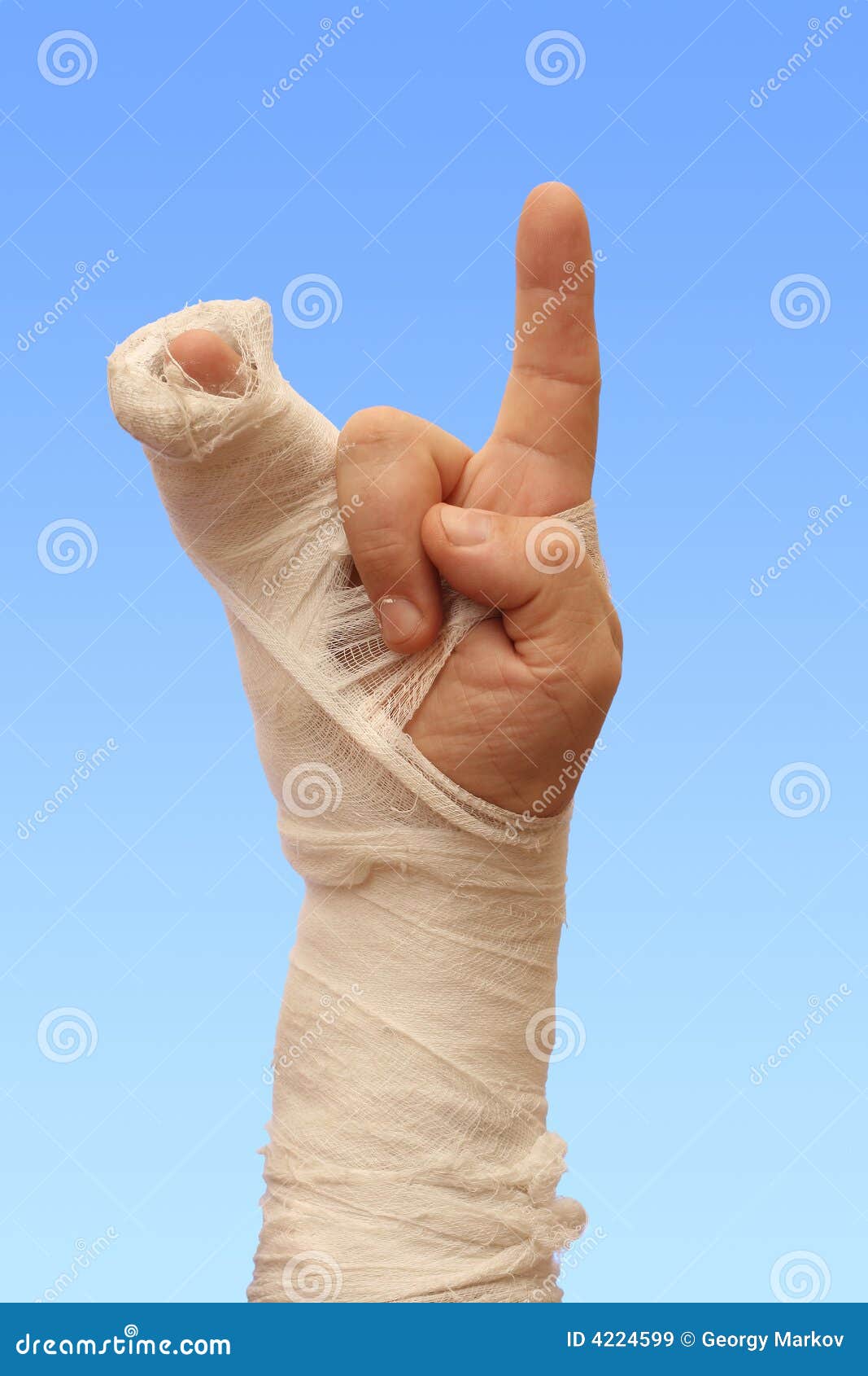 Man s hand in plaster stock image. Image of finger, plaster - 4224599