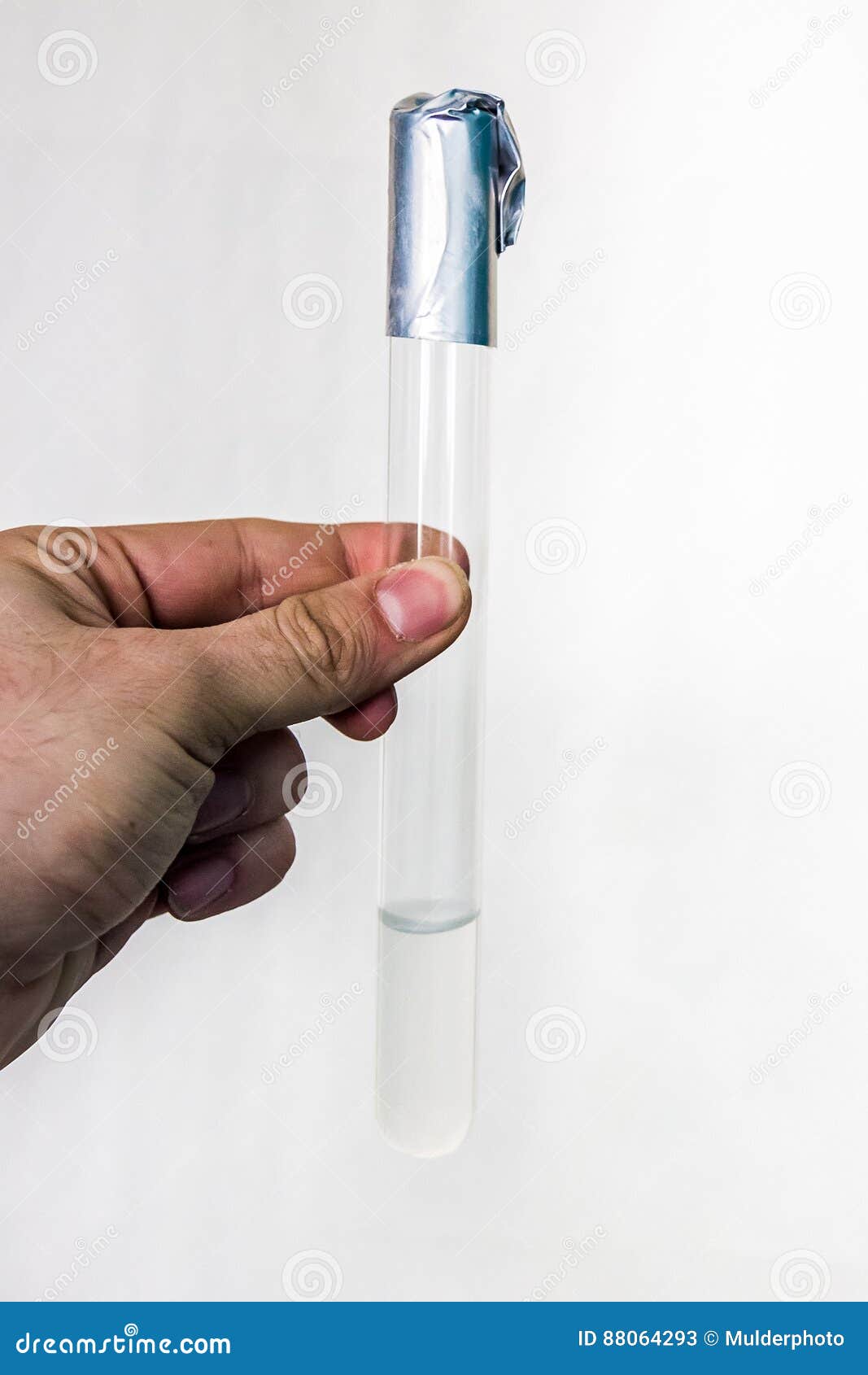 Man`s Hand with a Test Tube with a Nutrient Medium Based on Agar Stock ...