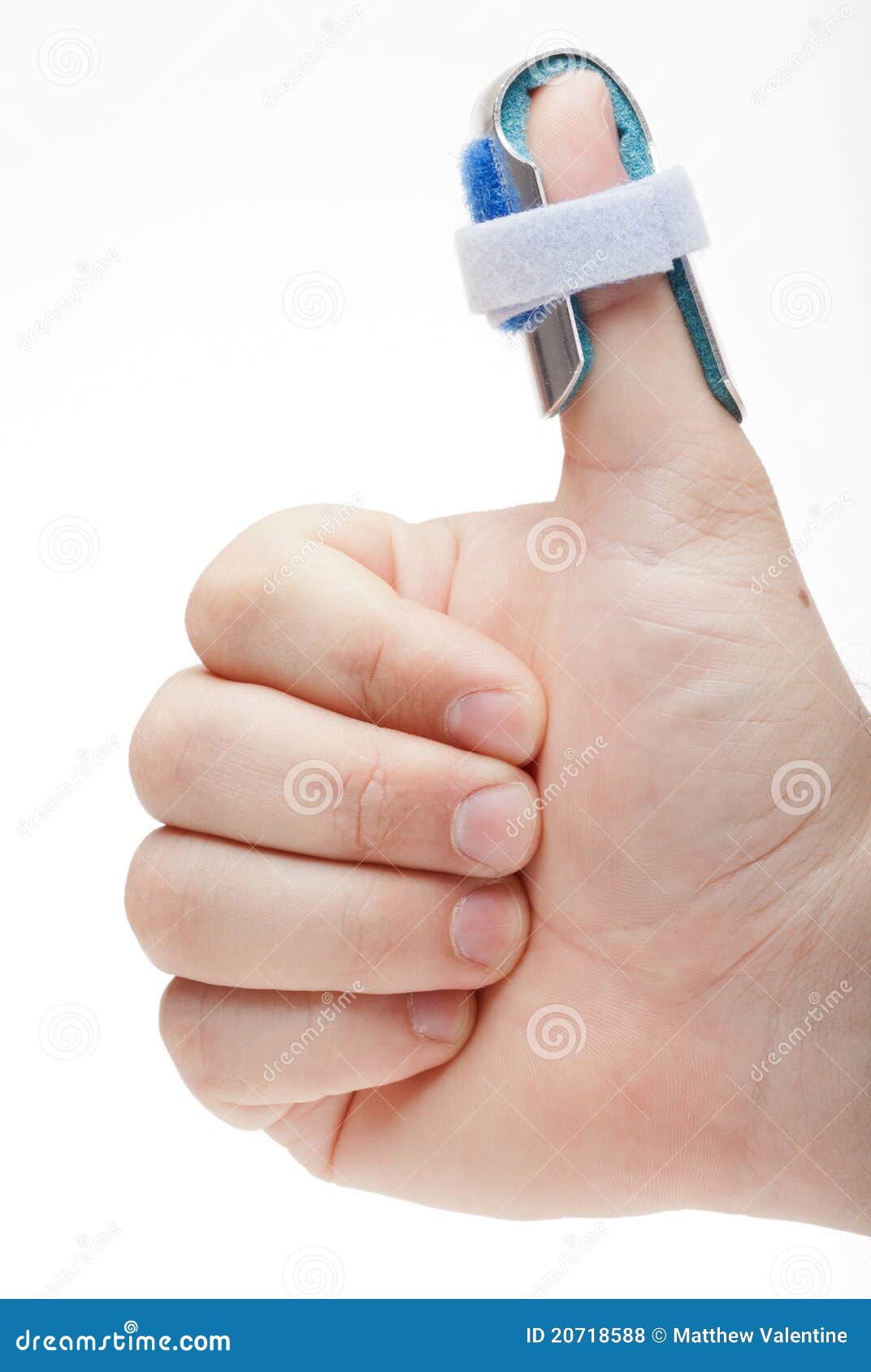 Man S Hand with Thumb Spint Stock Photo - Image of splint, gesture ...
