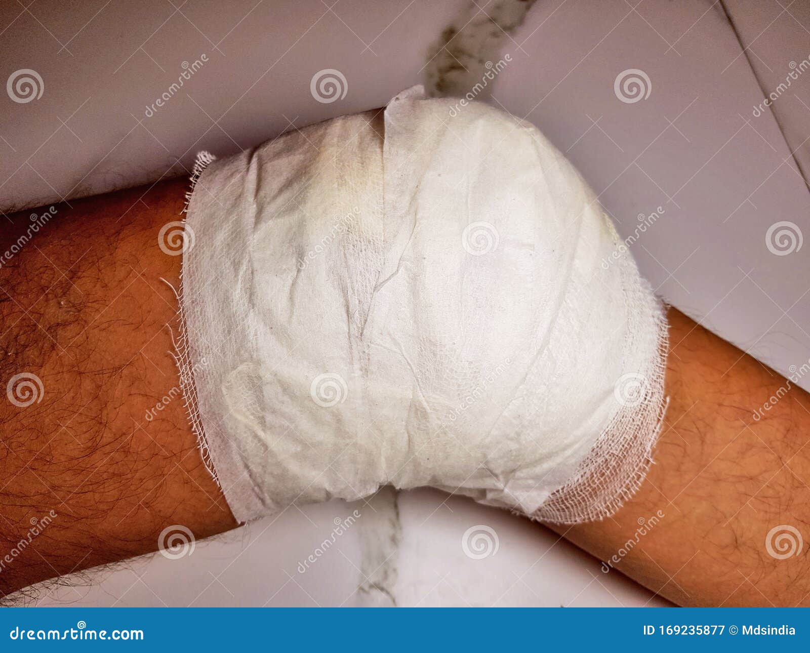 A man`s knee is bandaged stock image. Image of injury - 169235877