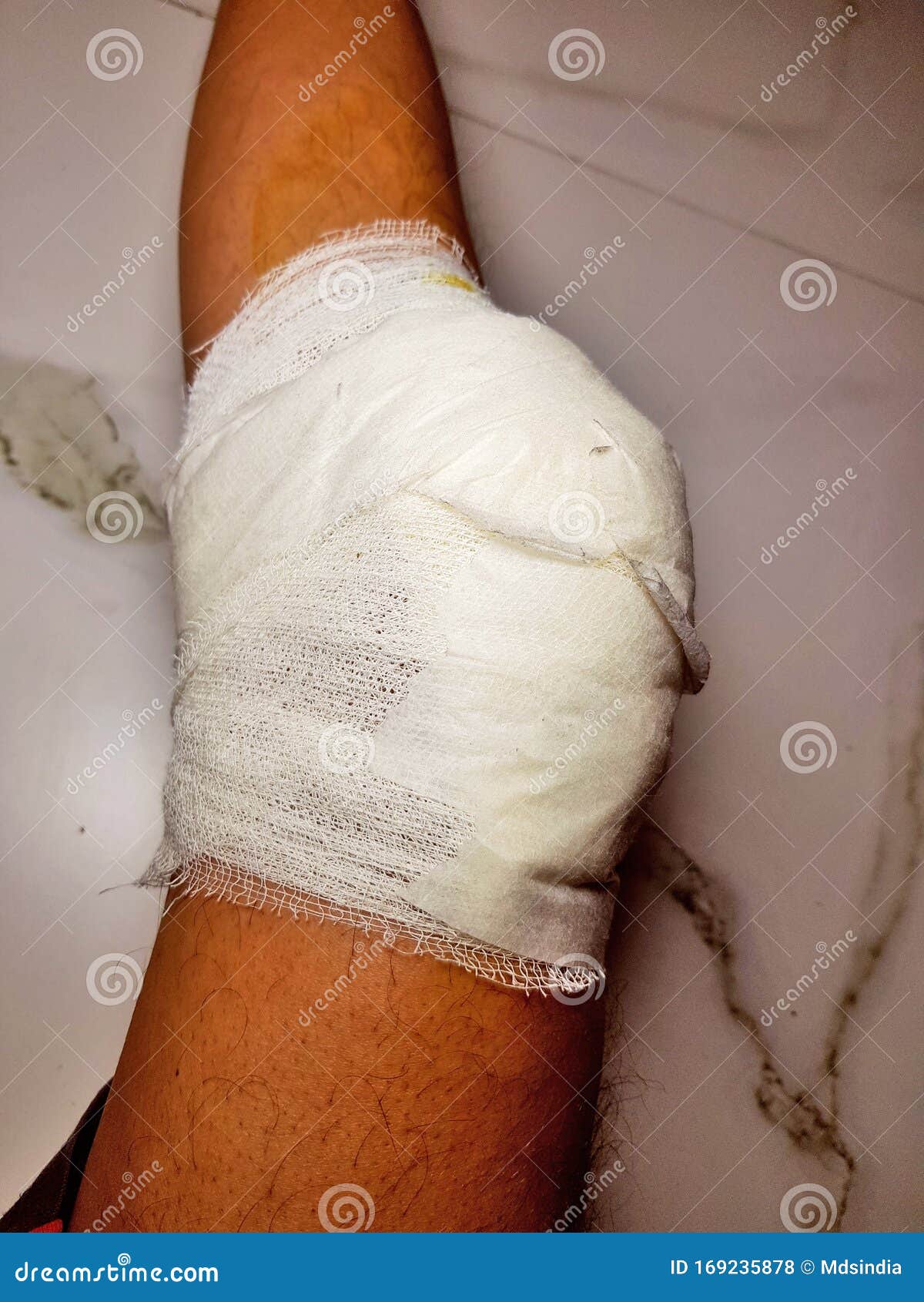 A man`s knee is bandaged stock photo. Image of pain - 169235878