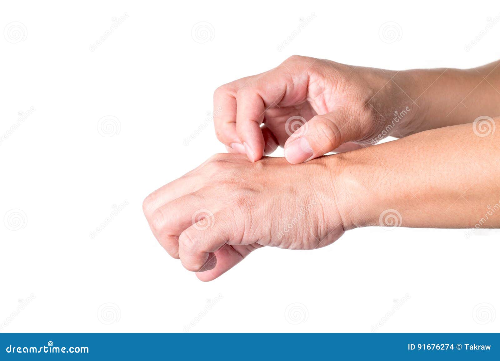 Man Scratch His Hand. Stock Photo | CartoonDealer.com #91676274