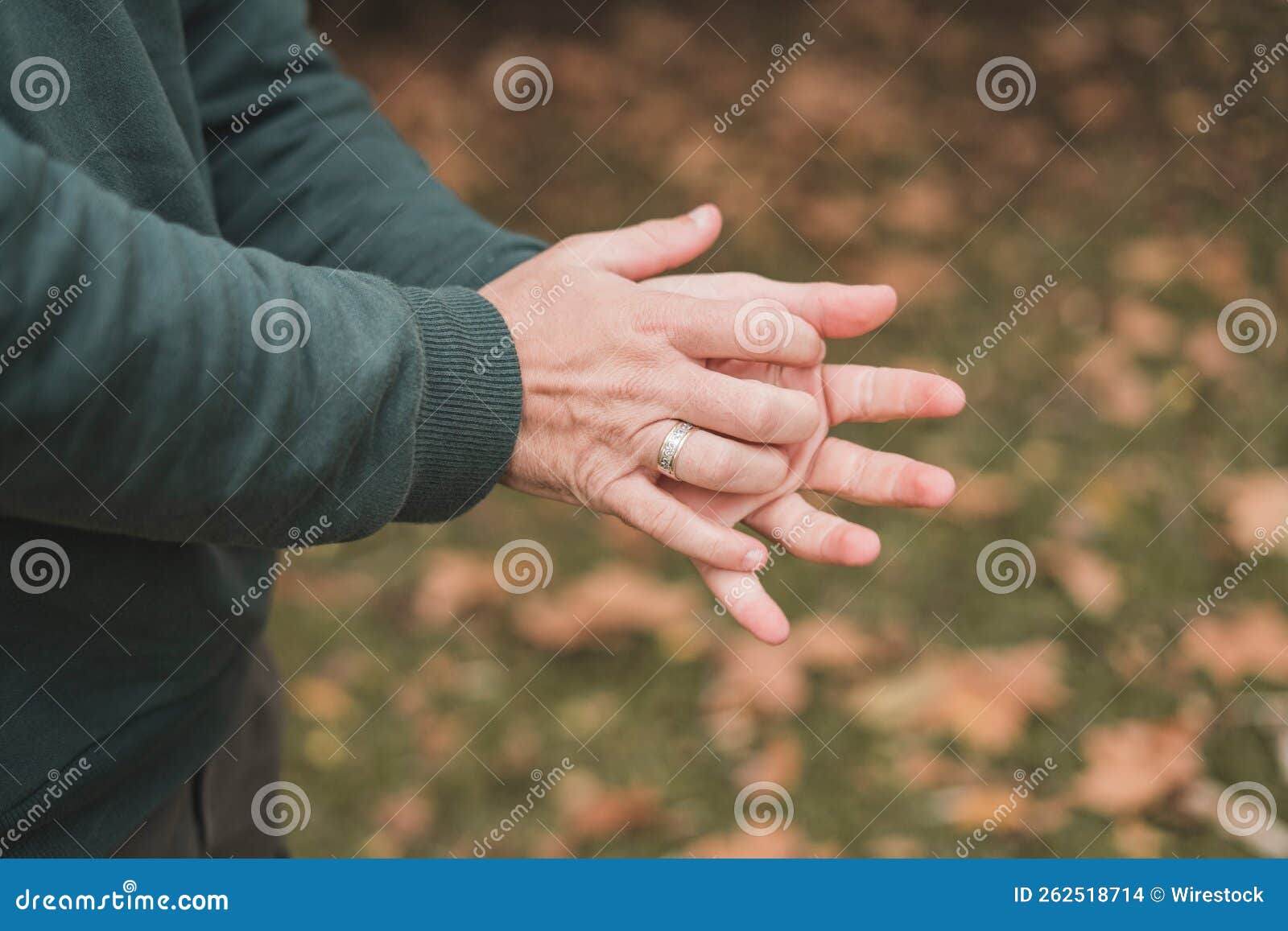 Man scratching his hand stock photo. Image of fingers - 262518714
