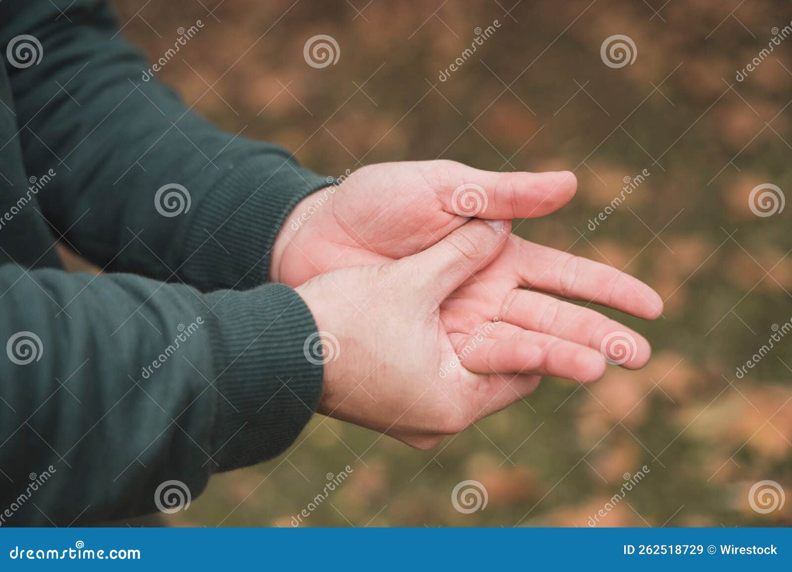 Man scratching his hand stock image. Image of fingers - 262518729