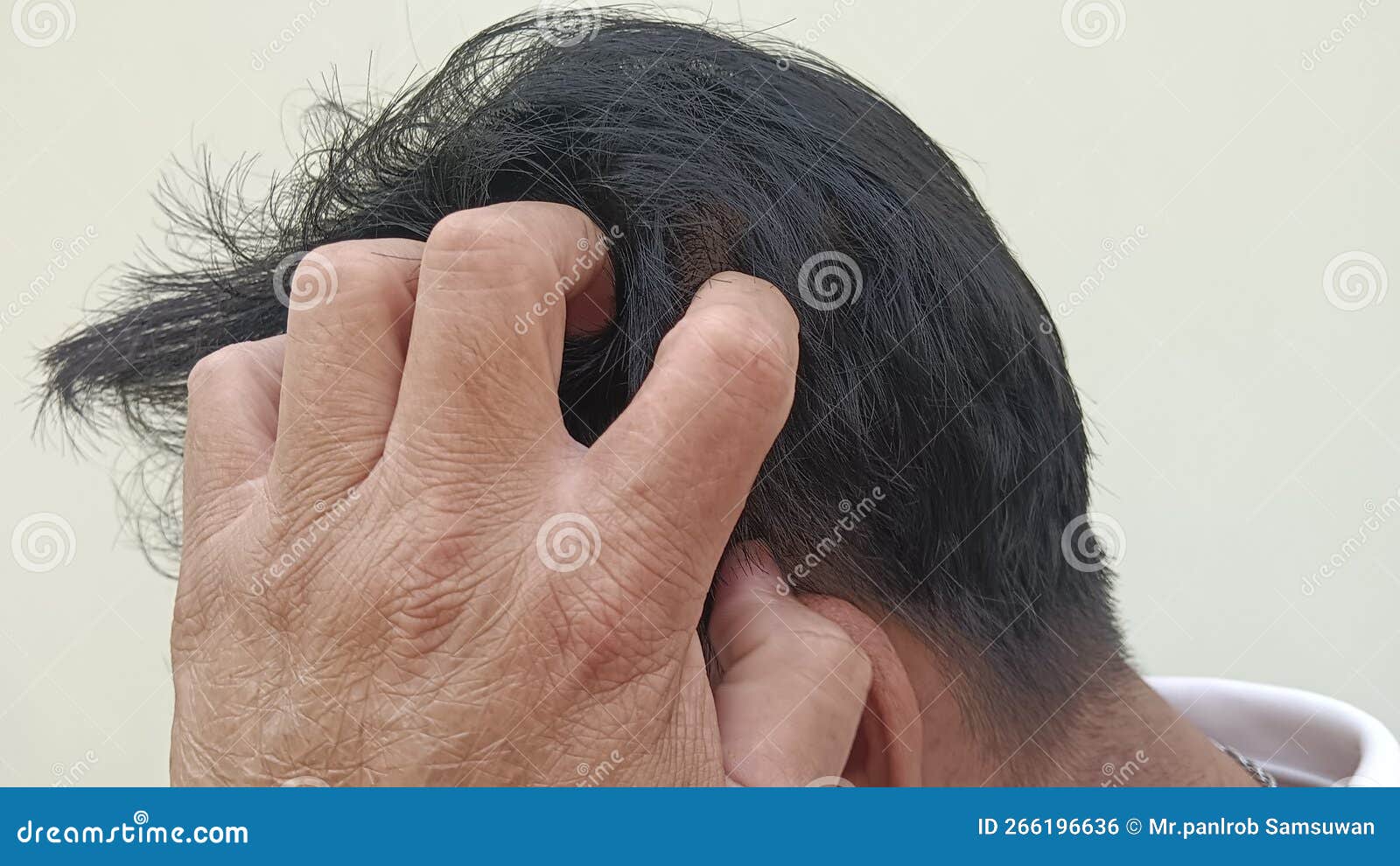 Man Scratching His Head with Dandruff Stock Photo - Image of longhair ...