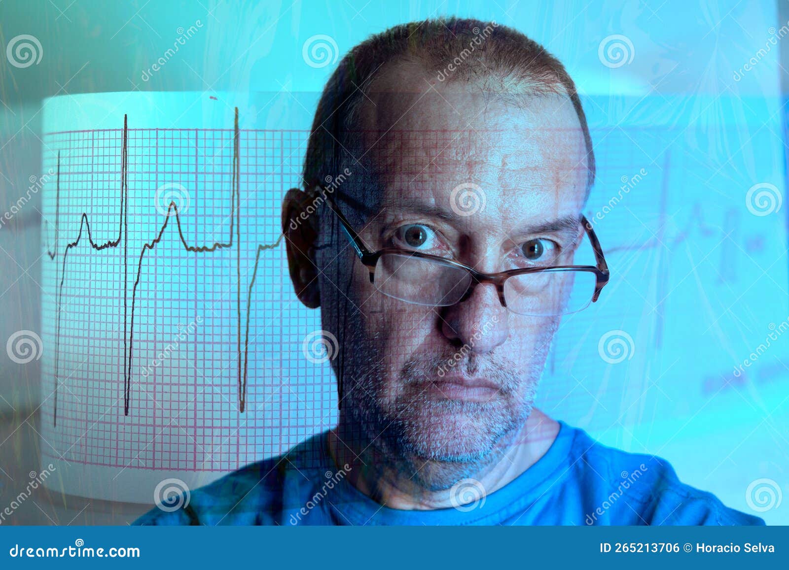 Man with a Serious Expression Looking at the Camera Superimposed on an ...