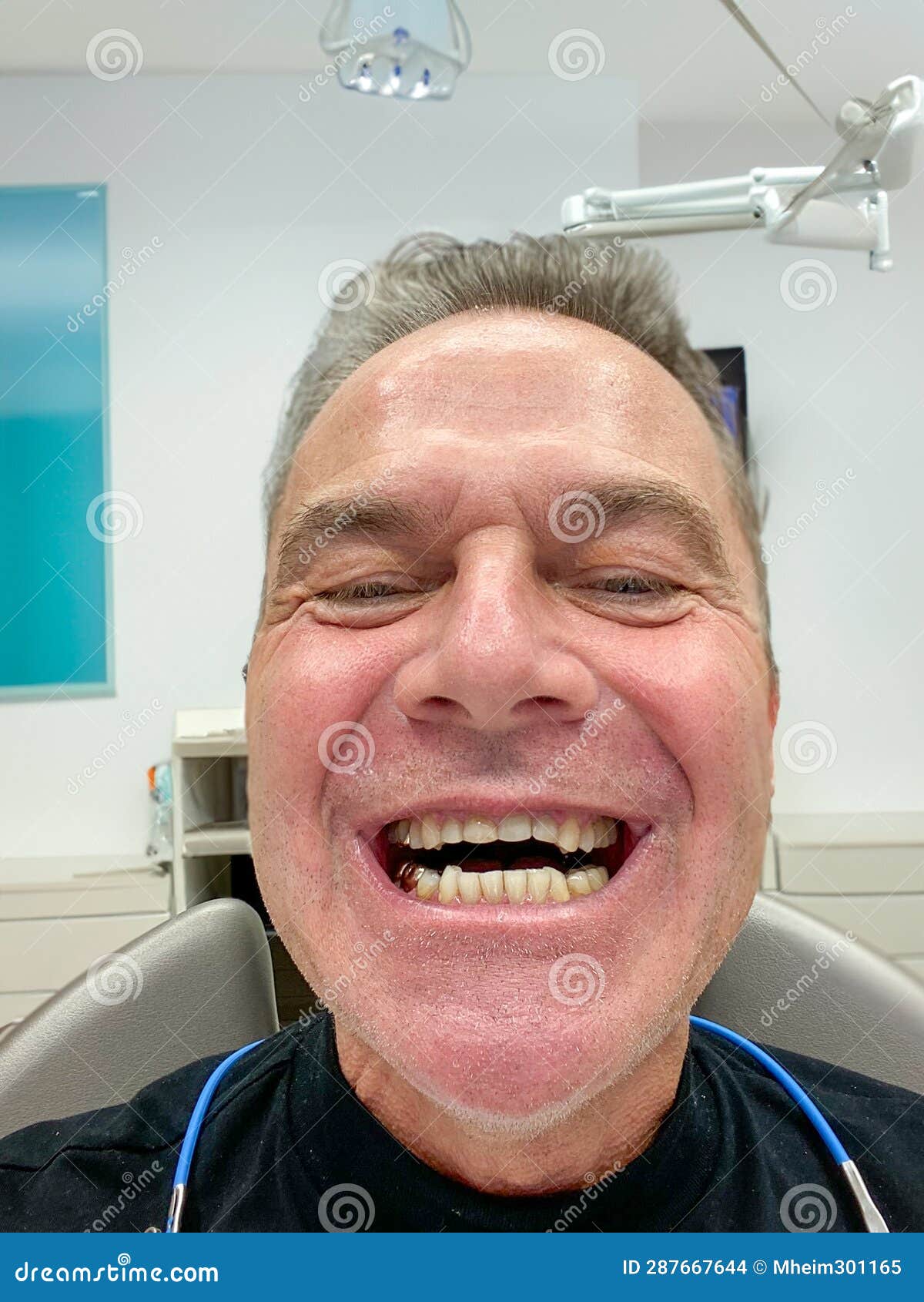 Man Showing His Old Teeth before Getting New Teeth at the Dentist Stock ...