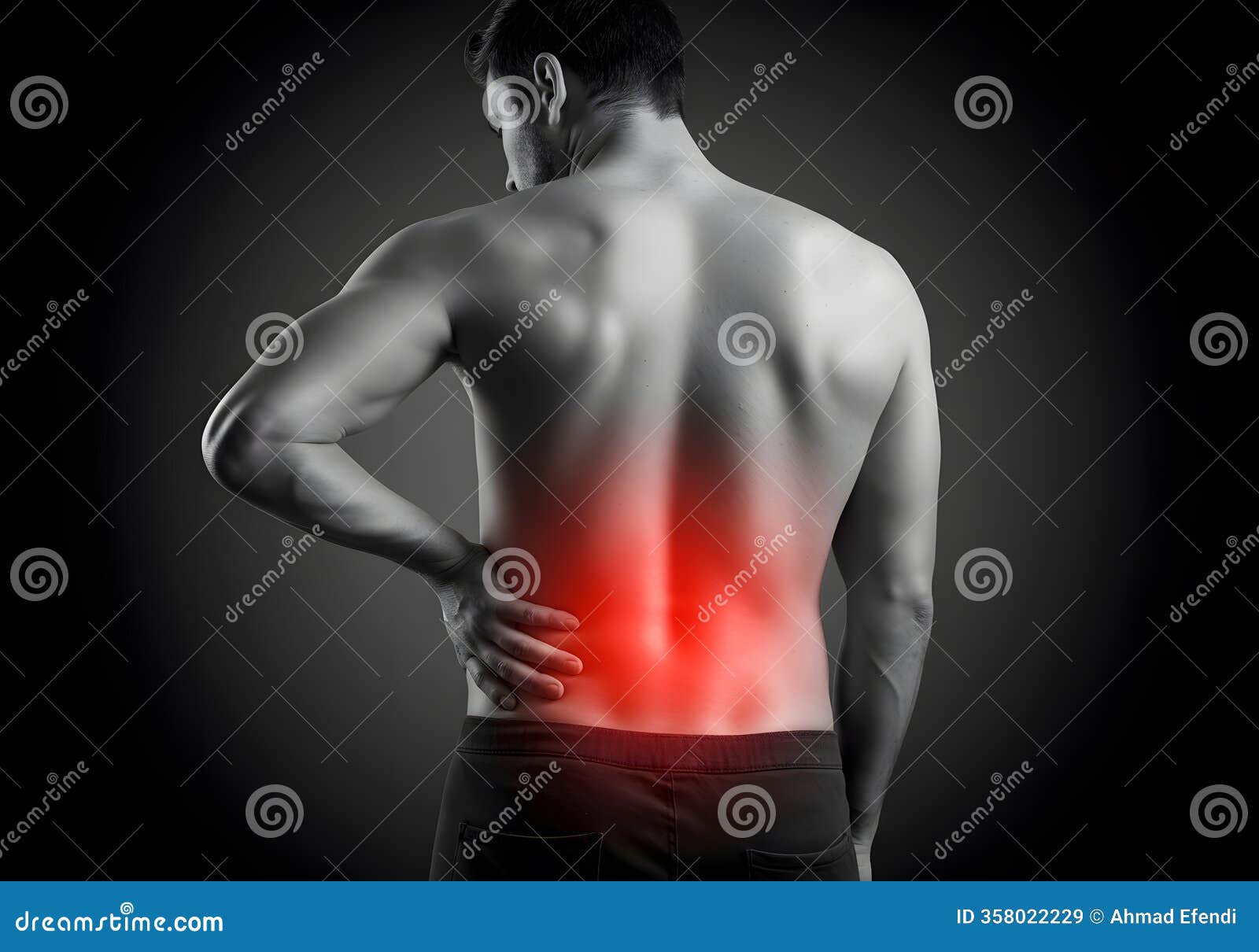 Man Experiencing Severe Lower Back Pain, Medical Illustration Showing ...