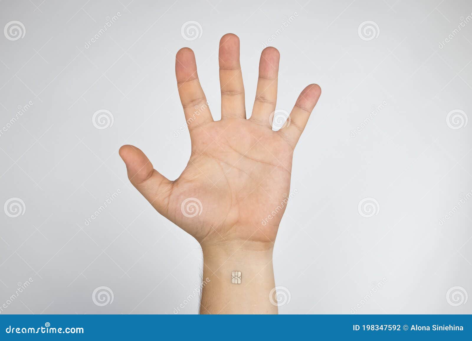 Hand With Implantation Of Micro Chip. X-Ray View Close-up. Chipization ...