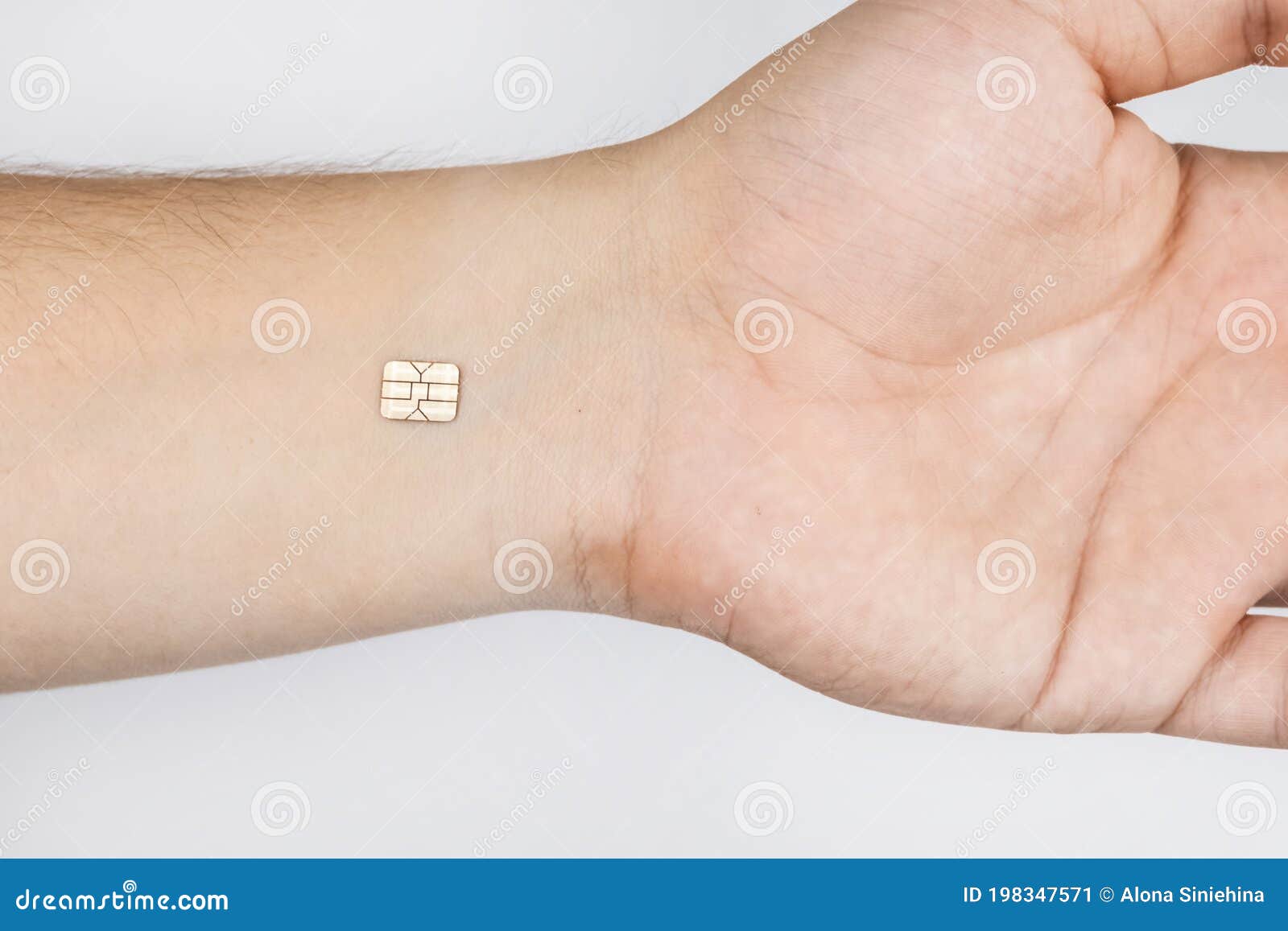 The Man Shows His Hand With A Chip Implanted. The Concept Of Chipping ...