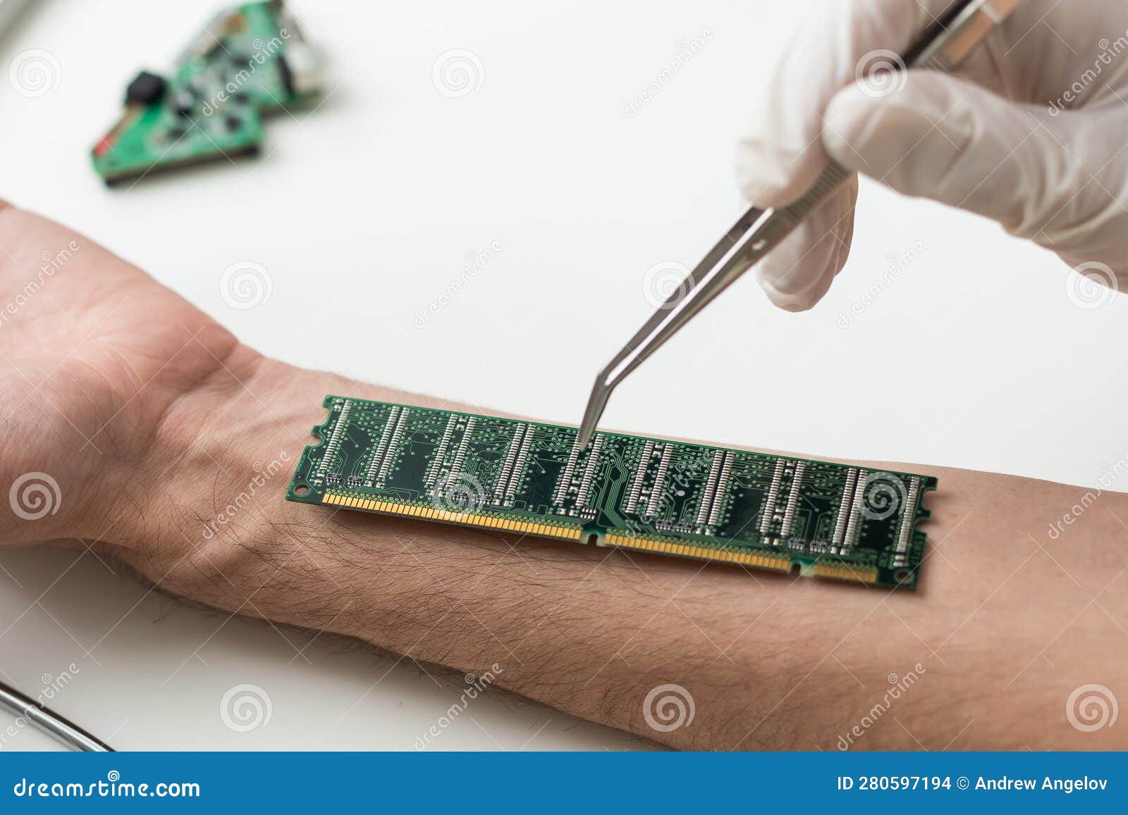 The Man Shows His Hand with a Chip Implanted. the Concept of Chipping ...