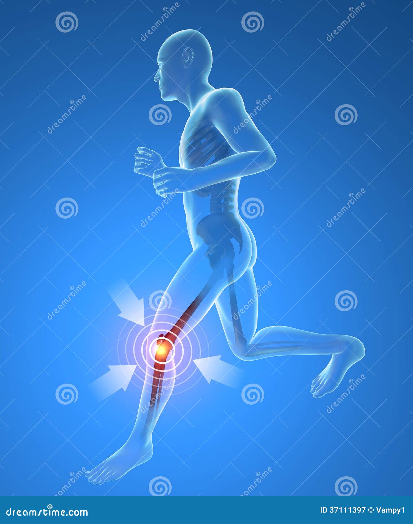 Man, Skeleton, Running, Knee Pain Inflammation Stock Illustration ...