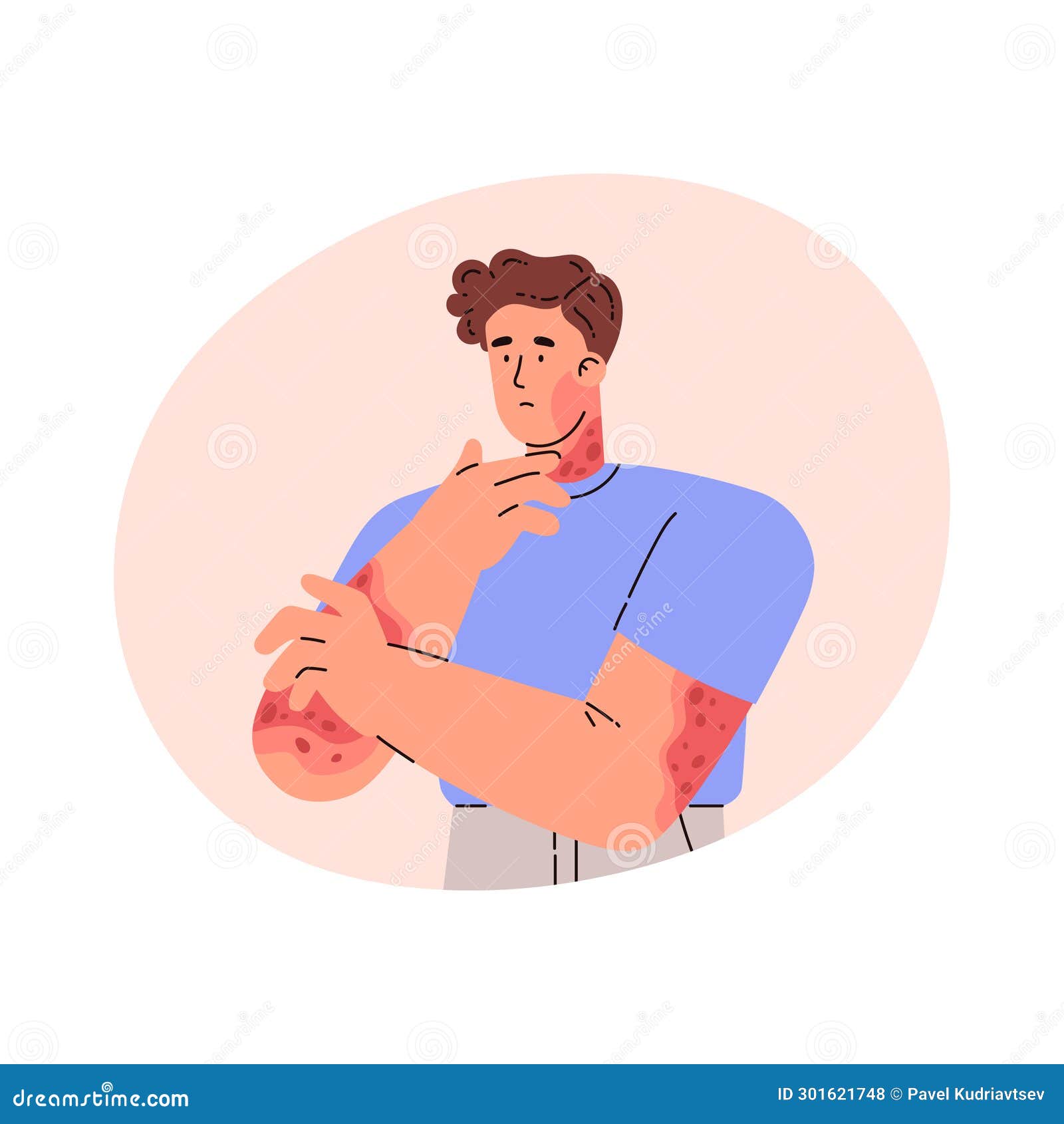 Urticaria Flat Landing Page Website Template. Tularemia, Warkany ...