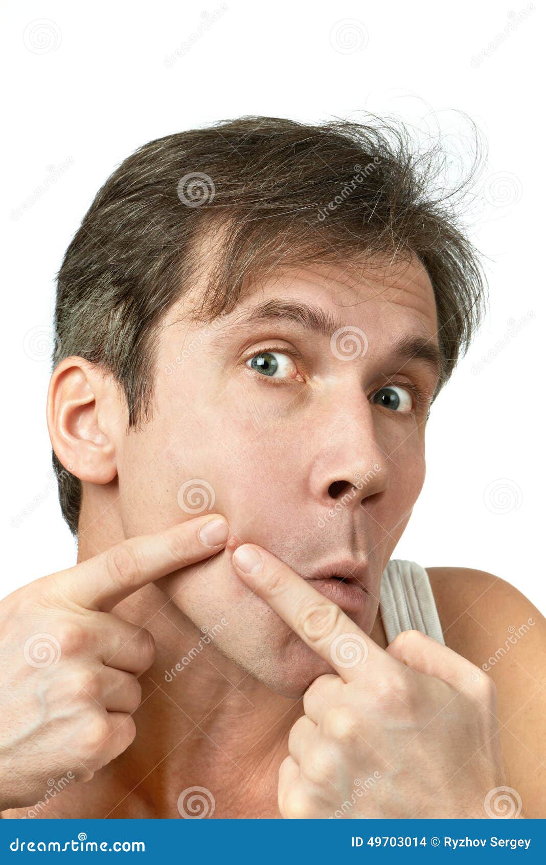 Man squeezing a pimple stock photo. Image of model, background - 49703014