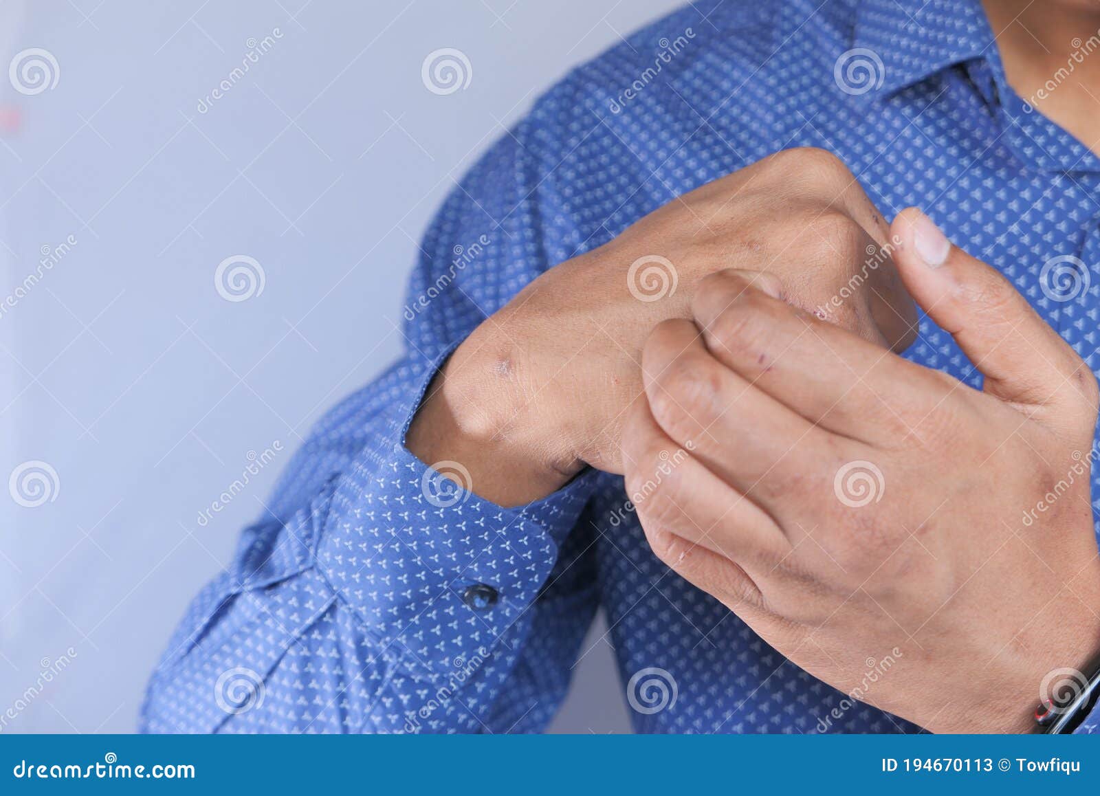 Man Suffering from Itching Skin, Close Up. Stock Image - Image of skin ...