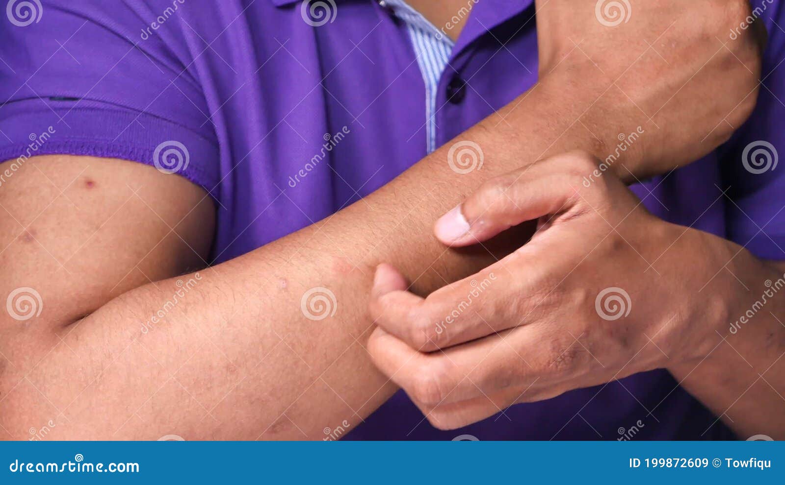 Man Suffering from Itching Skin, Close Up. Stock Video - Video of ...