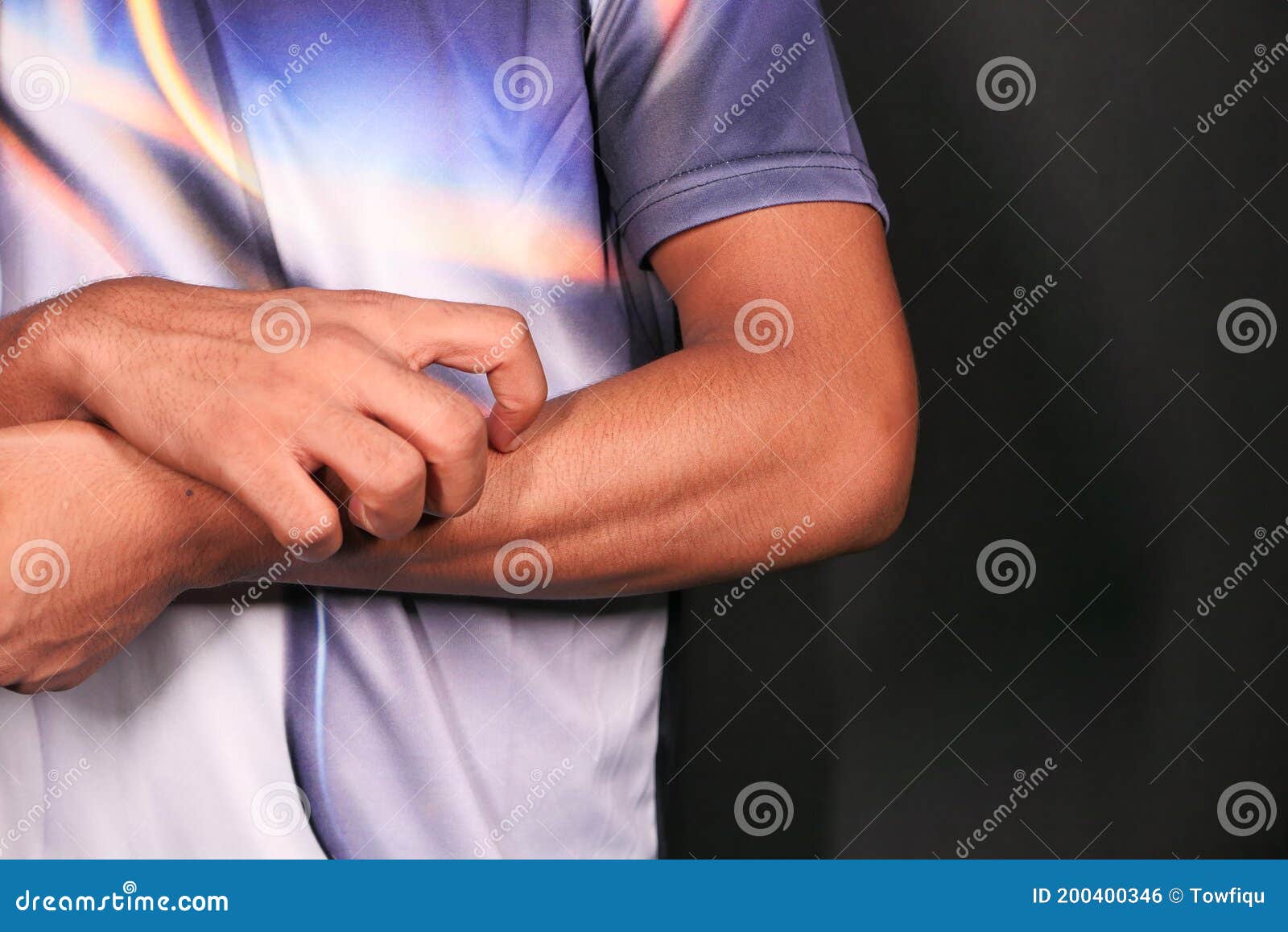 Man Suffering from Itching Skin, Close Up. Stock Photo - Image of bleed ...