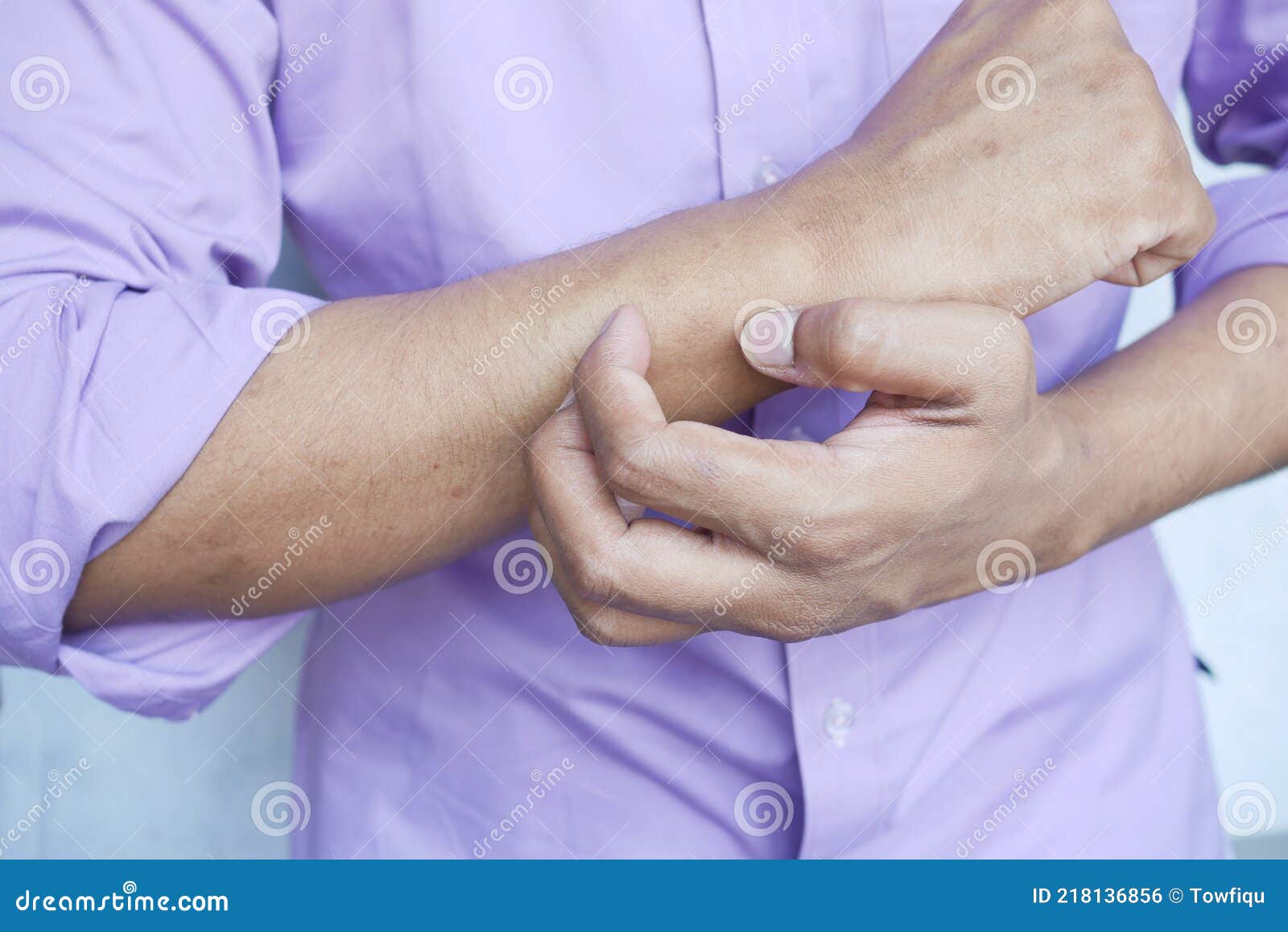 Man Suffering from Itching Skin, Close Up. Stock Photo - Image of male ...
