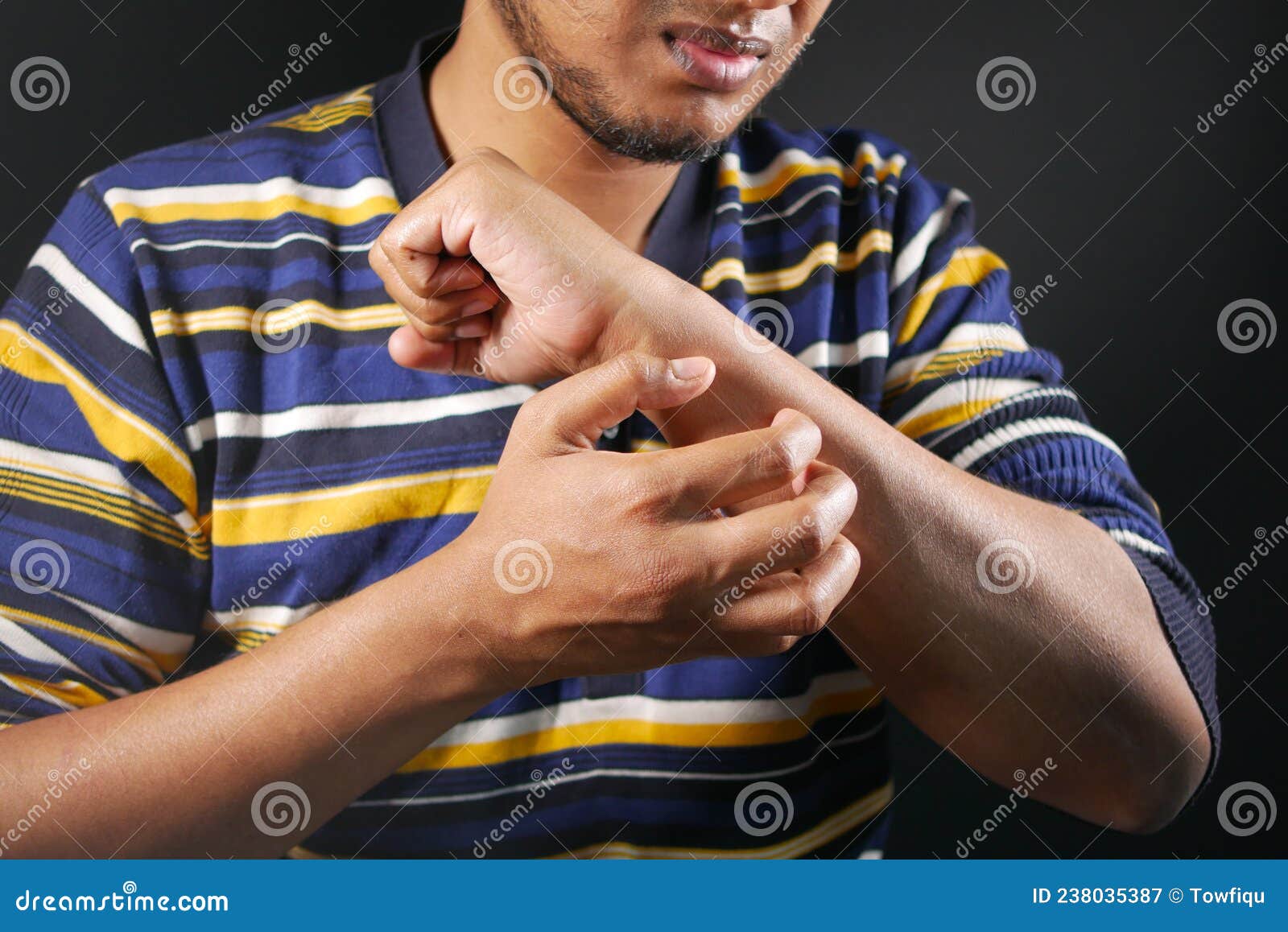 Man Suffering from Itching Skin, Close Up. Stock Image - Image of ...
