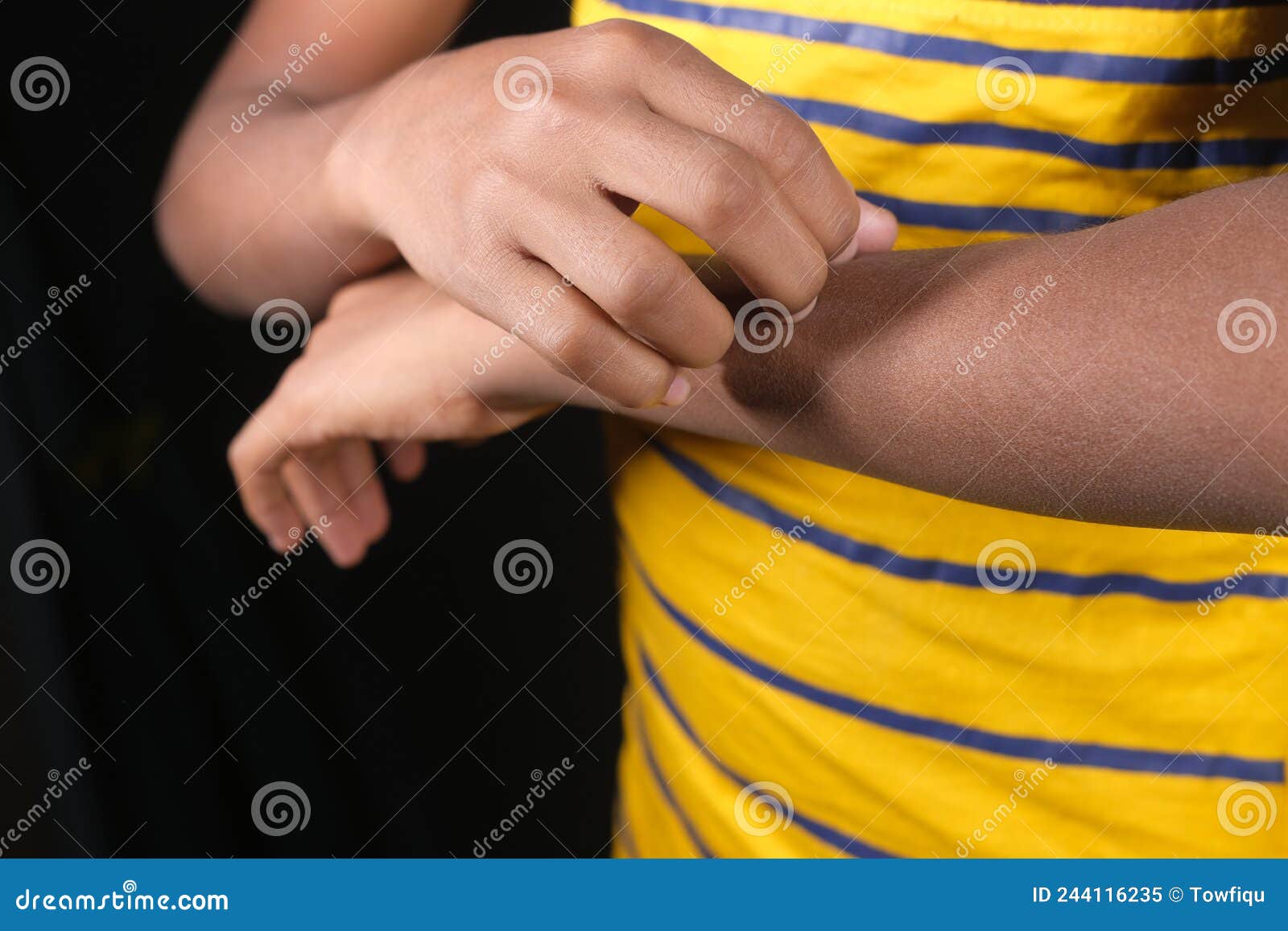 Man Suffering from Itching Skin, Close Up. Stock Image - Image of ...