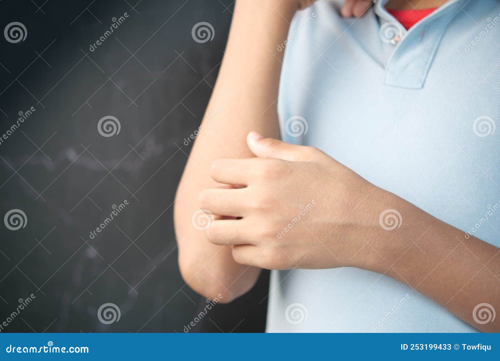 Man Suffering from Itching Skin, Close Up. Stock Image - Image of pain ...