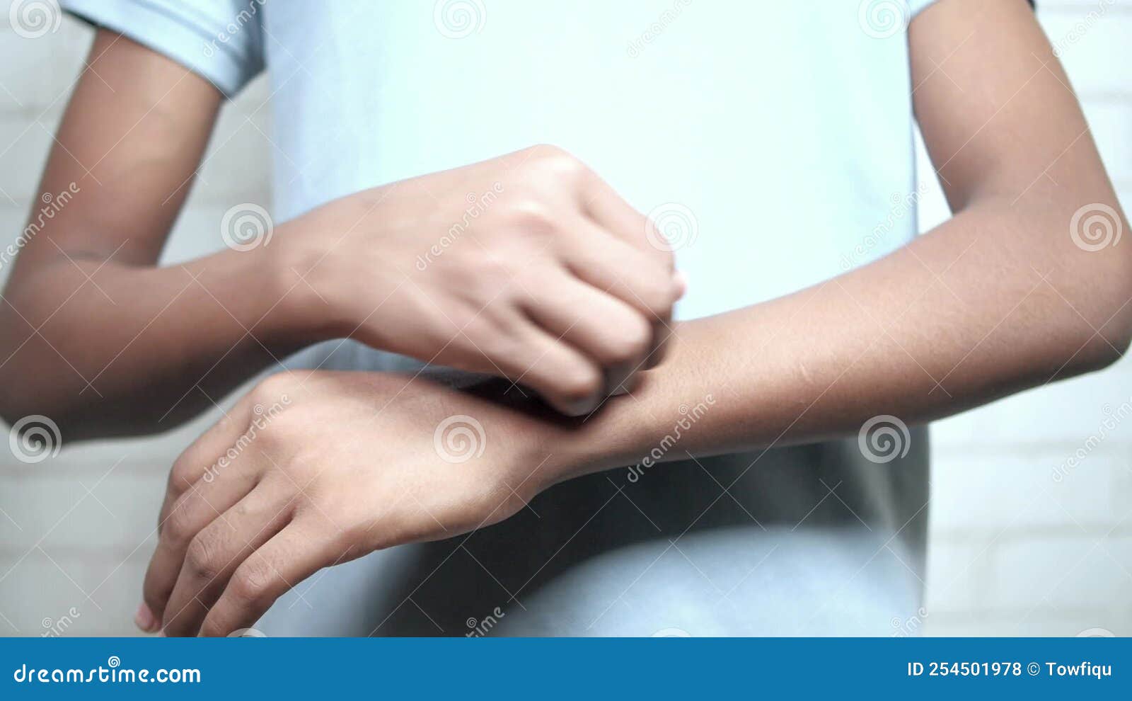 Man Suffering from Itching Skin, Close Up. Stock Footage - Video of ...