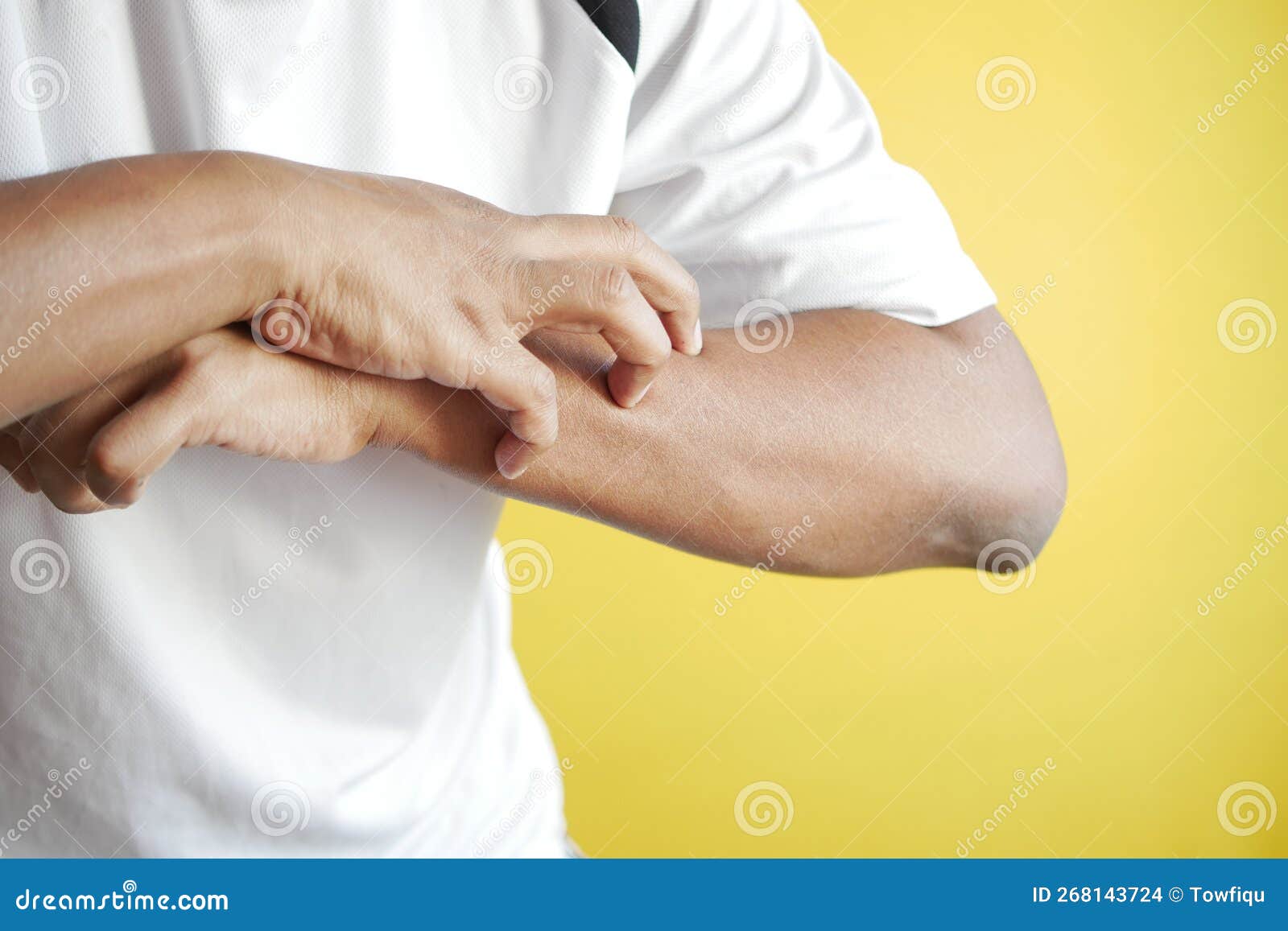 Man Suffering from Itching Skin, Close Up. Stock Photo - Image of ...