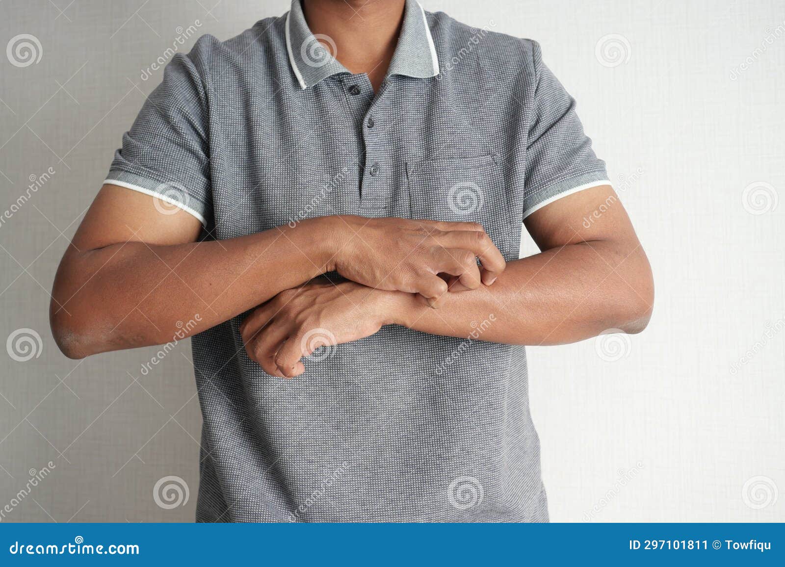 Man Suffering from Itching Skin, Close Up. Stock Image - Image of male ...