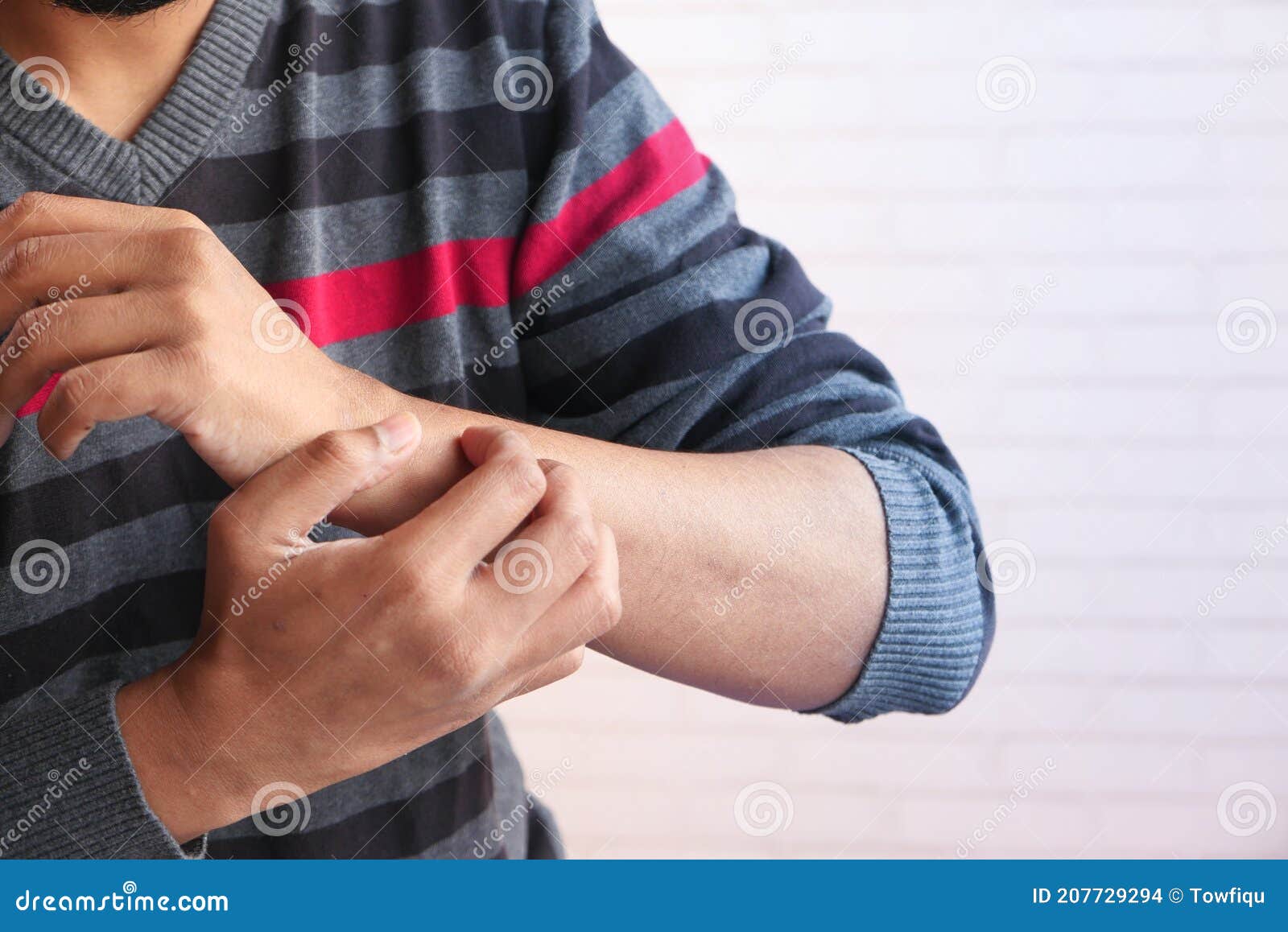 Young Man S Hand Suffering from Itching Skin Stock Photo - Image of ...