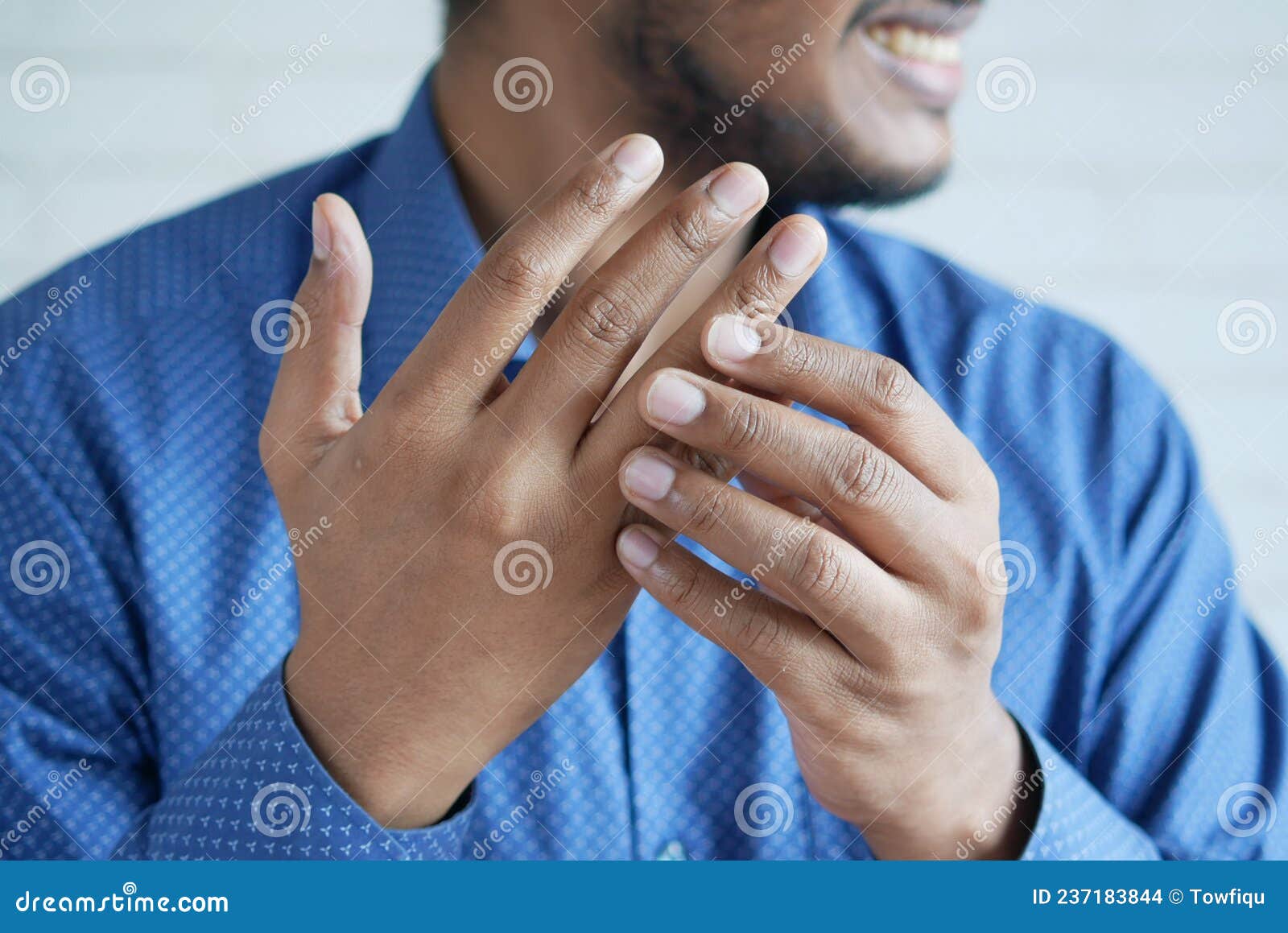 Man Suffering Pain in Hand Close Up Stock Photo - Image of chronic ...