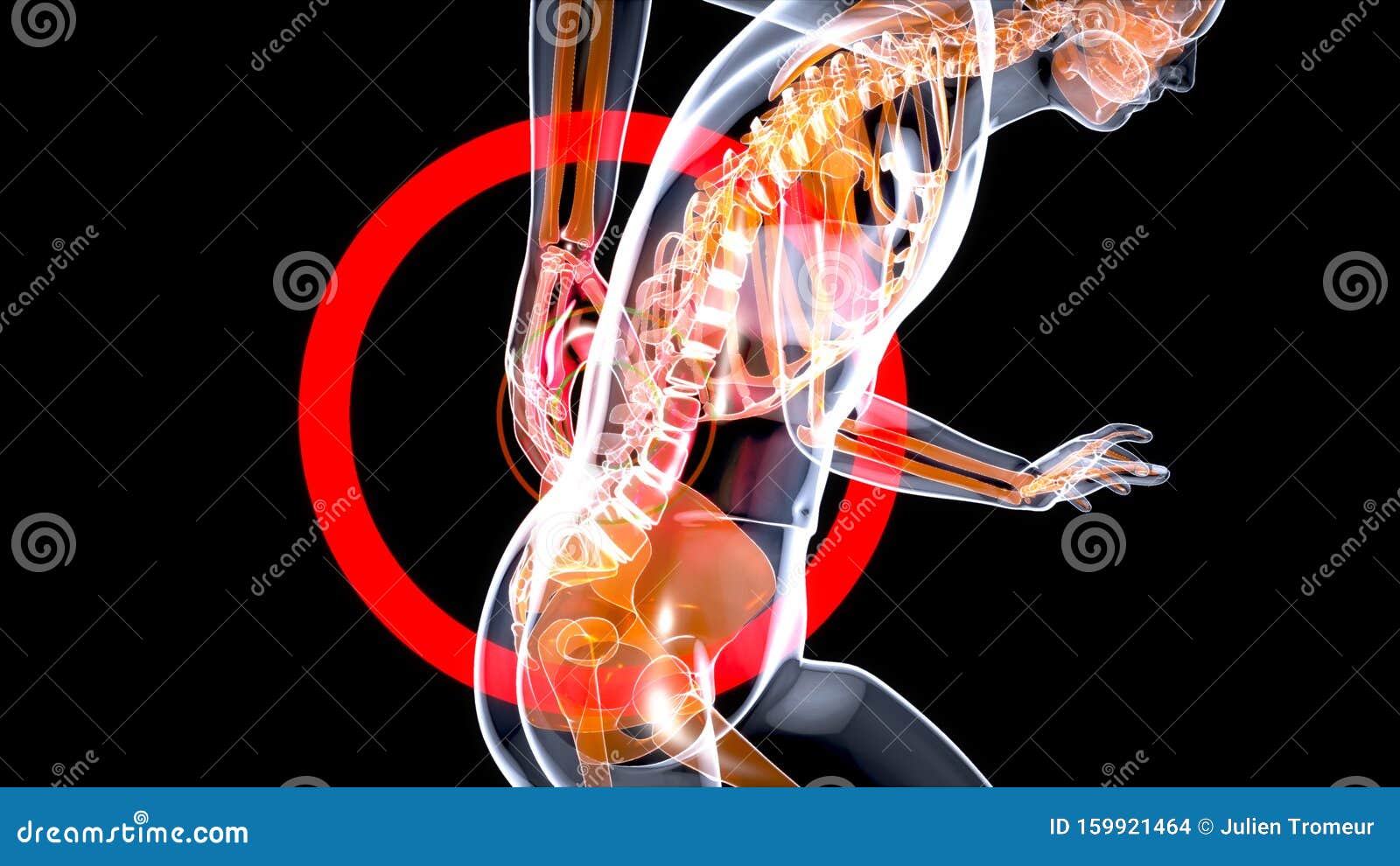 Man Suffering from Severe Back Pain Stock Illustration - Illustration ...