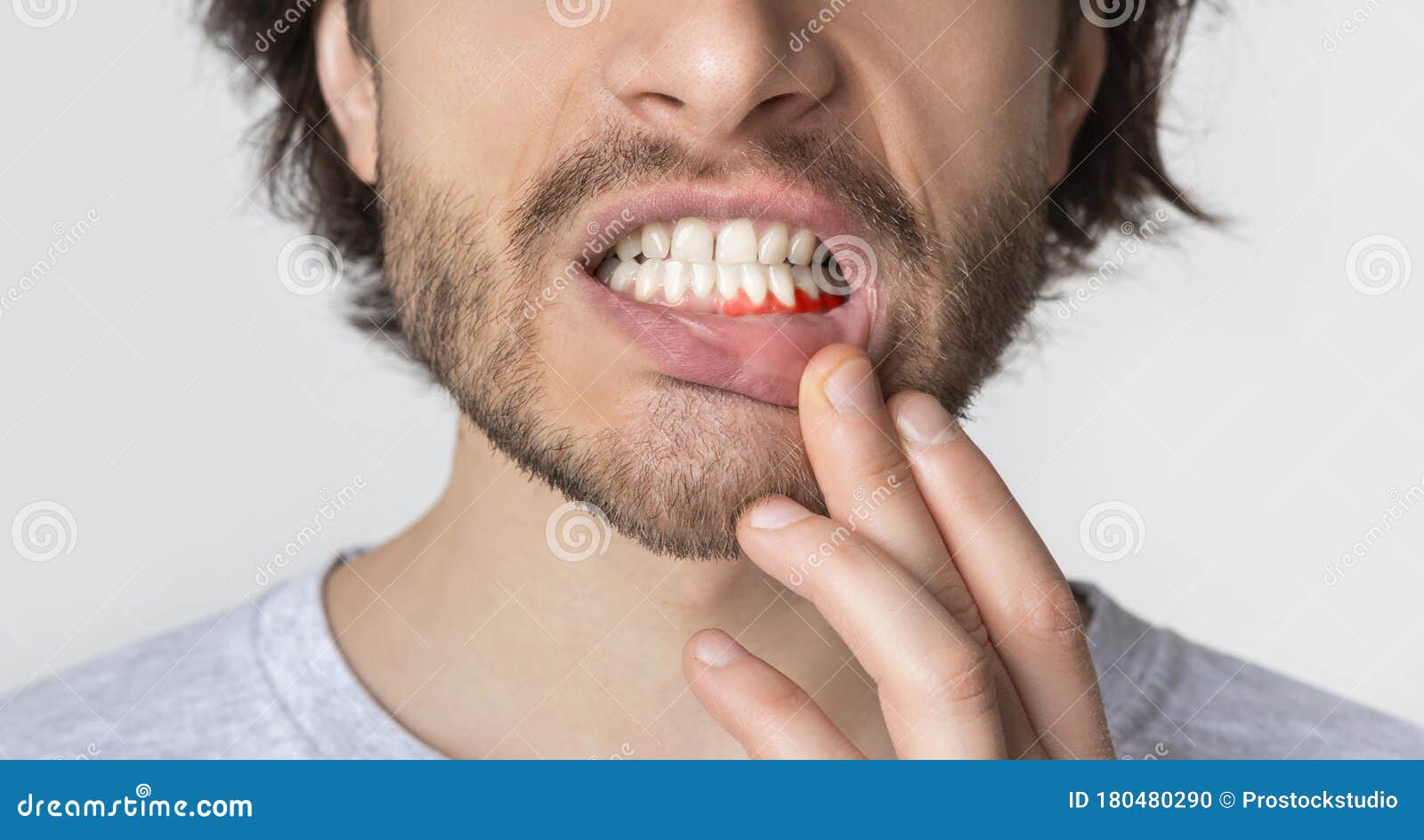 Man Suffering from Toothache, Tooth Decay or Sensitivity Stock Photo ...