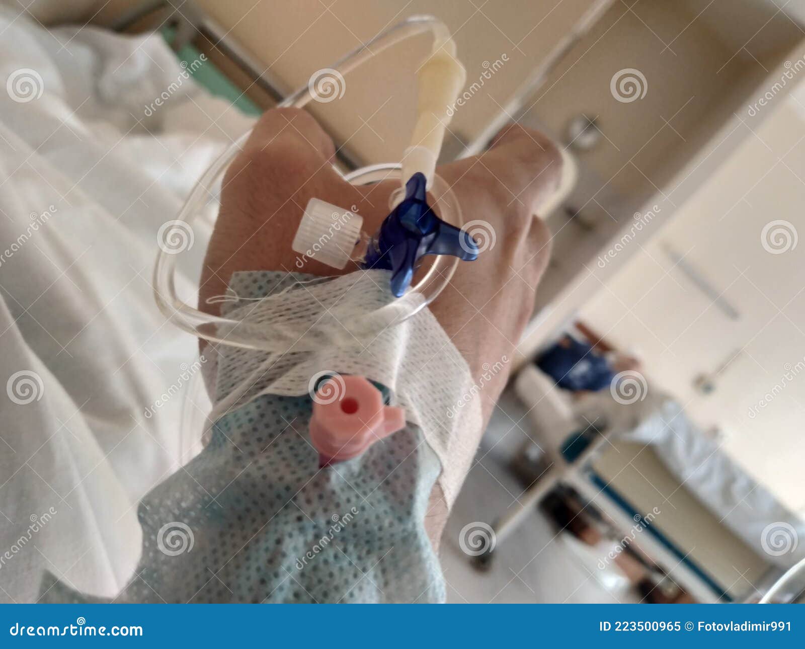 Man after Surgery with Dropper in Hand in Hospital Stock Image - Image ...