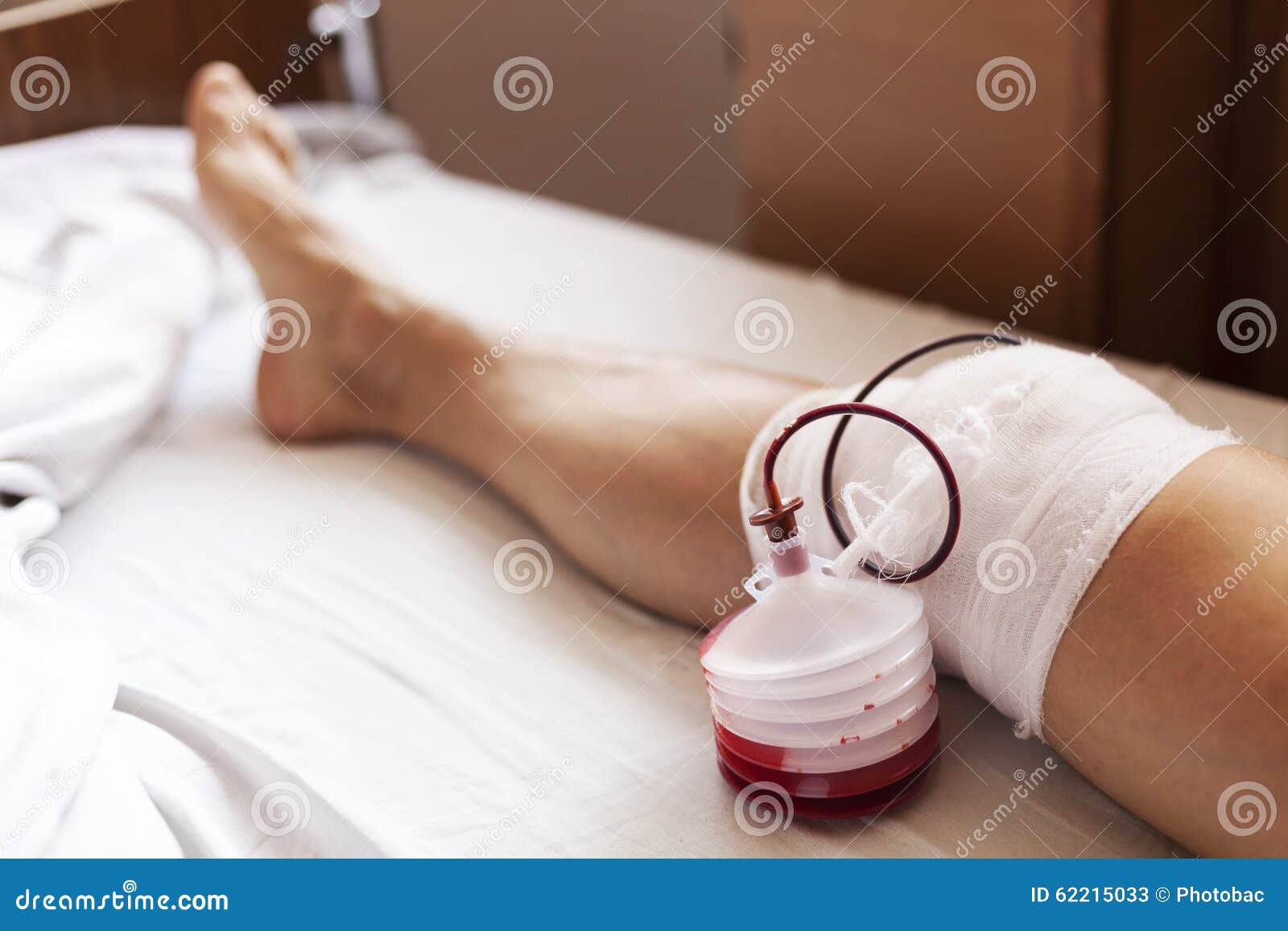 Man Surgery Leg Lying Hospital Bed Photos - Free & Royalty-Free Stock ...