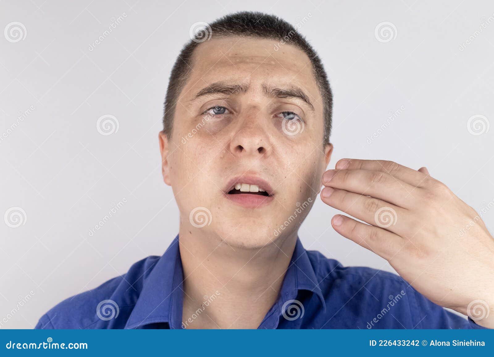 A Man with Sweating on His Face is Looking at the Camera. Sweat Gland ...