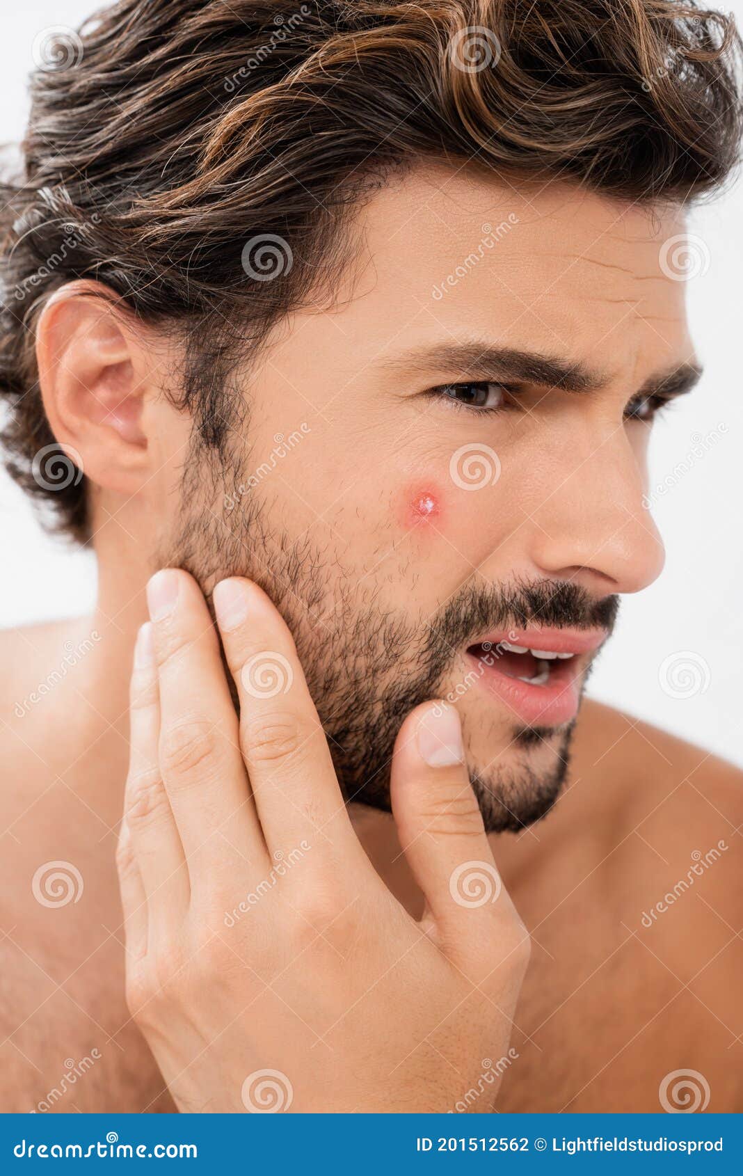 Man Touching Cheek with Acne Isolated Stock Photo - Image of gray ...