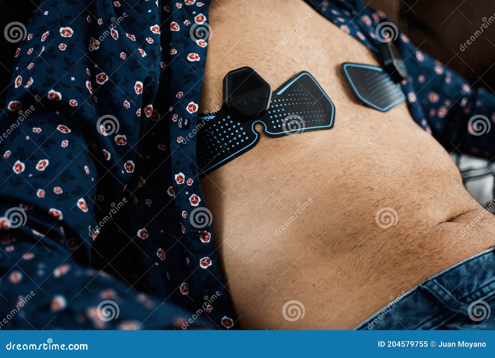 Man Using an Electrical Muscle Stimulation Device Stock Image - Image ...