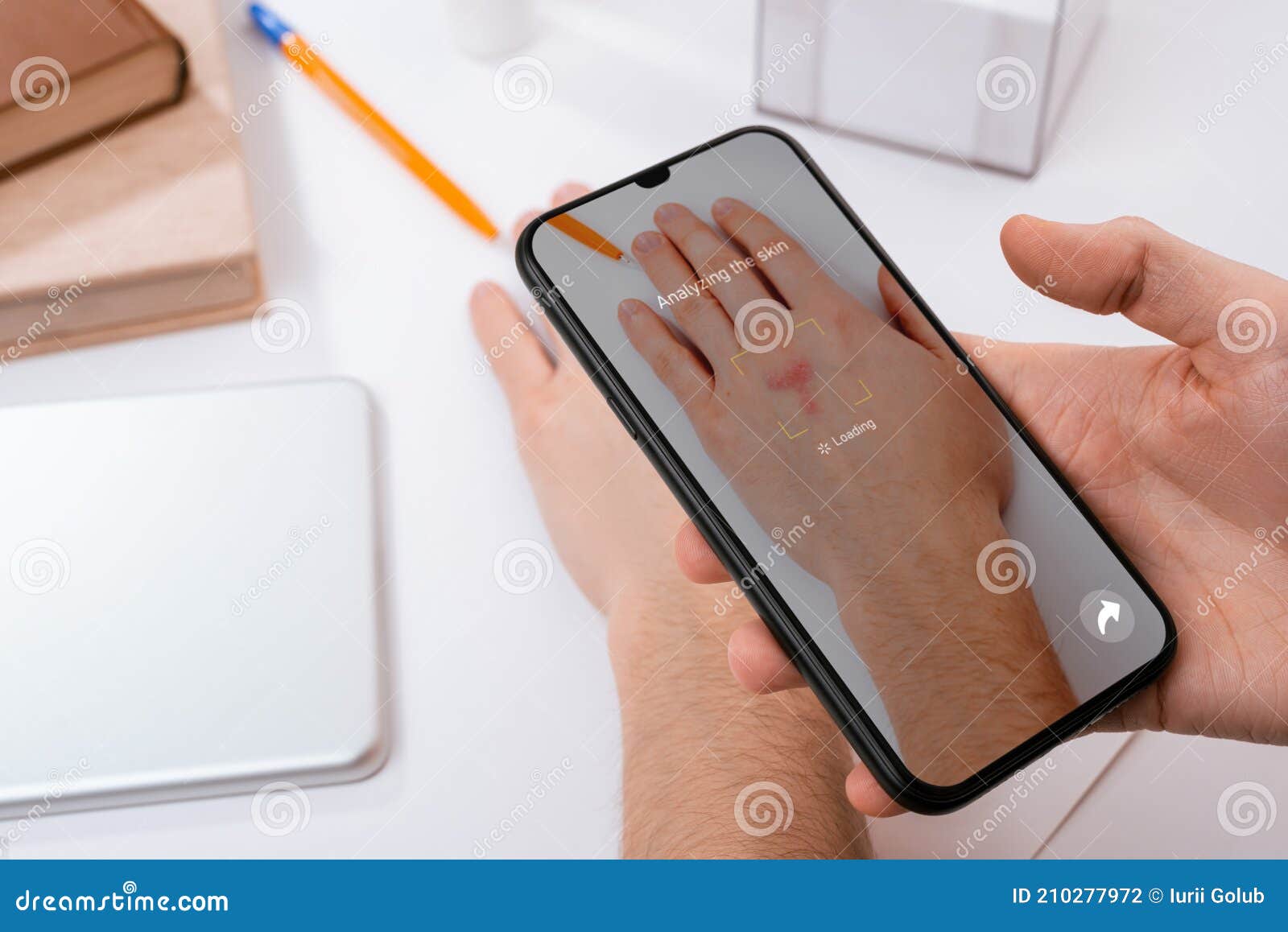 Man Using a Phone App To Recognize Skin Problems on His Hand Stock ...