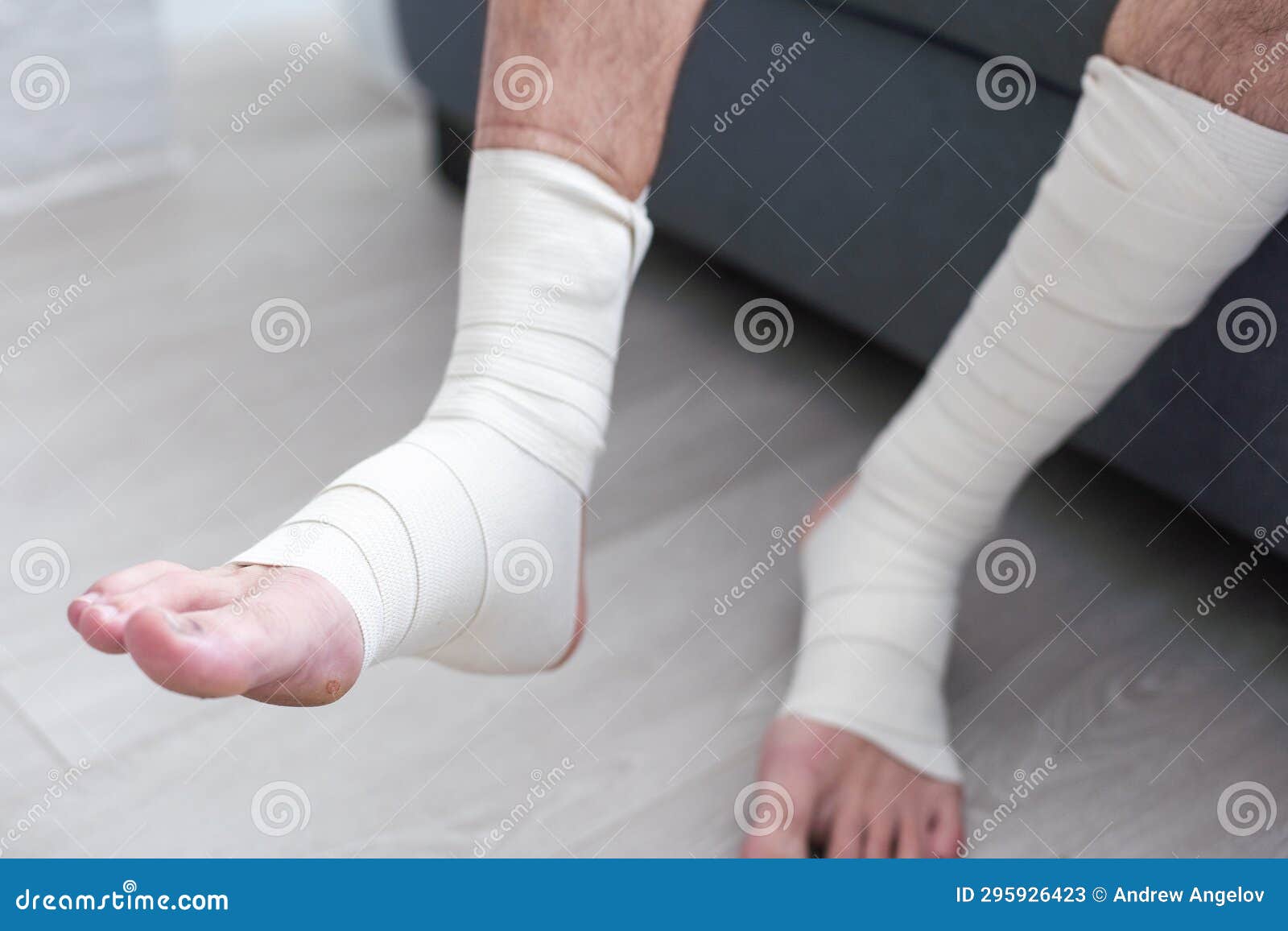 Man Using Put on Elastic Bandage with Legs Having Leg Pain Stock Image ...