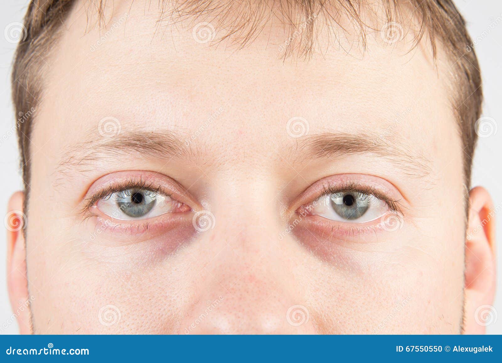 Man vermoeide ogen stock foto. Image of geneeskunde, kaukasisch - 67550550