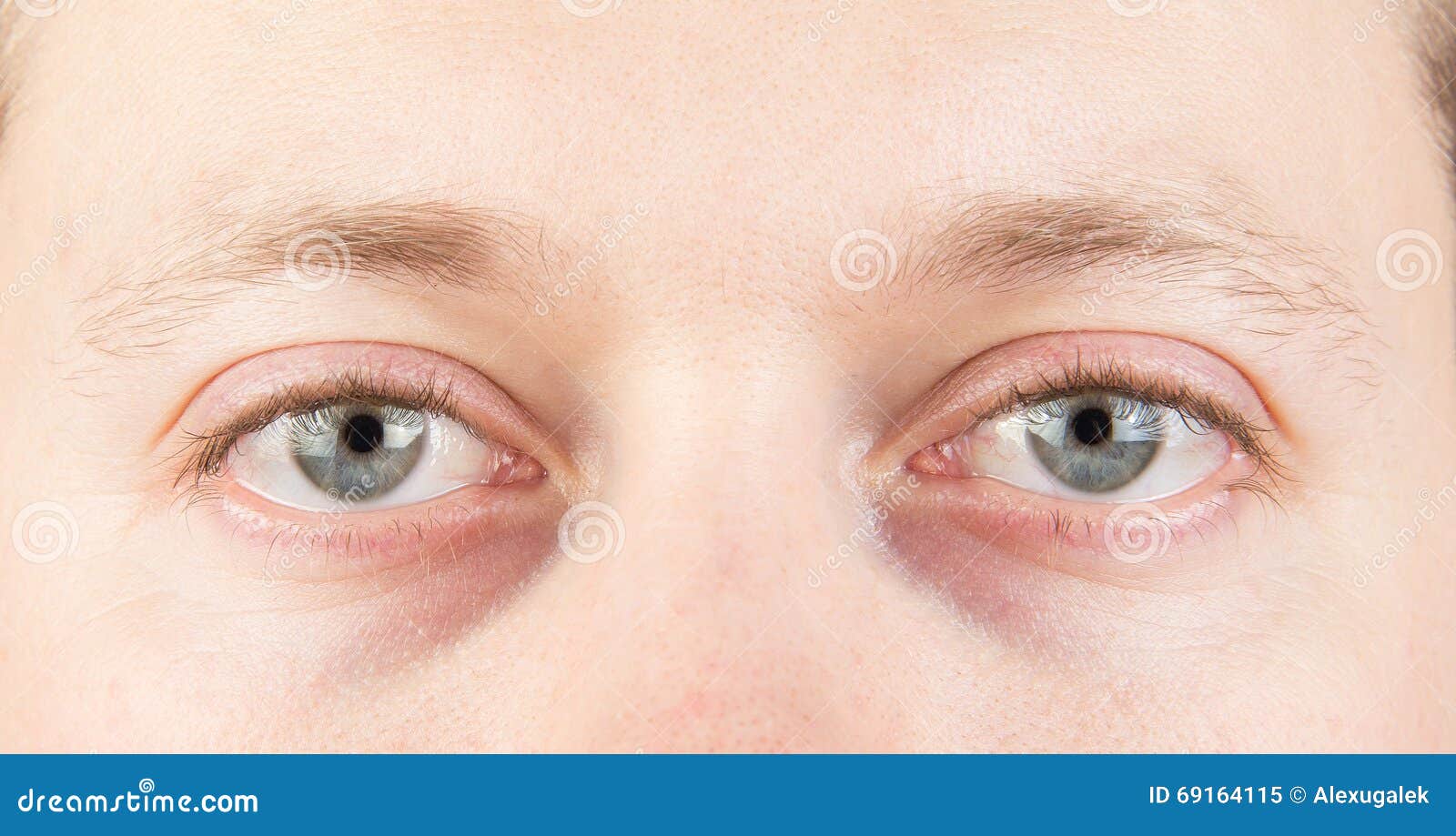 Man vermoeide ogen stock afbeelding. Image of macro, cirkels - 69164115