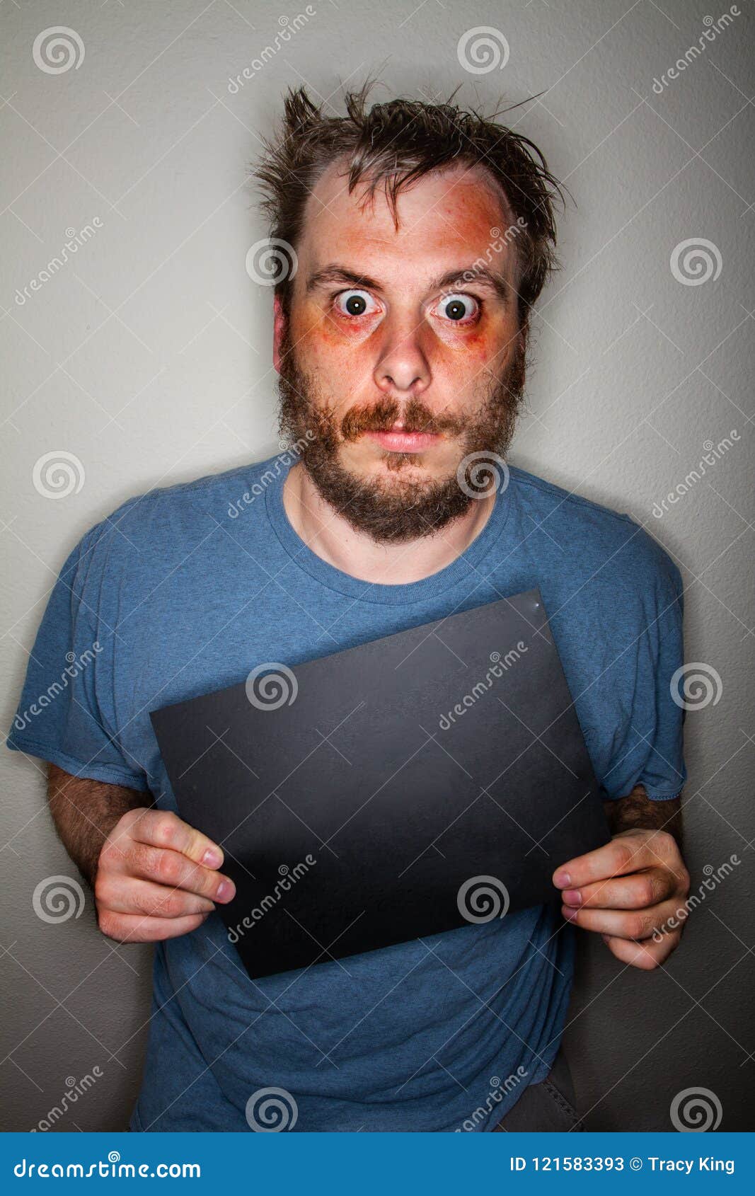 Drugged Out Man Holding a Sign Stock Image - Image of healthcare ...