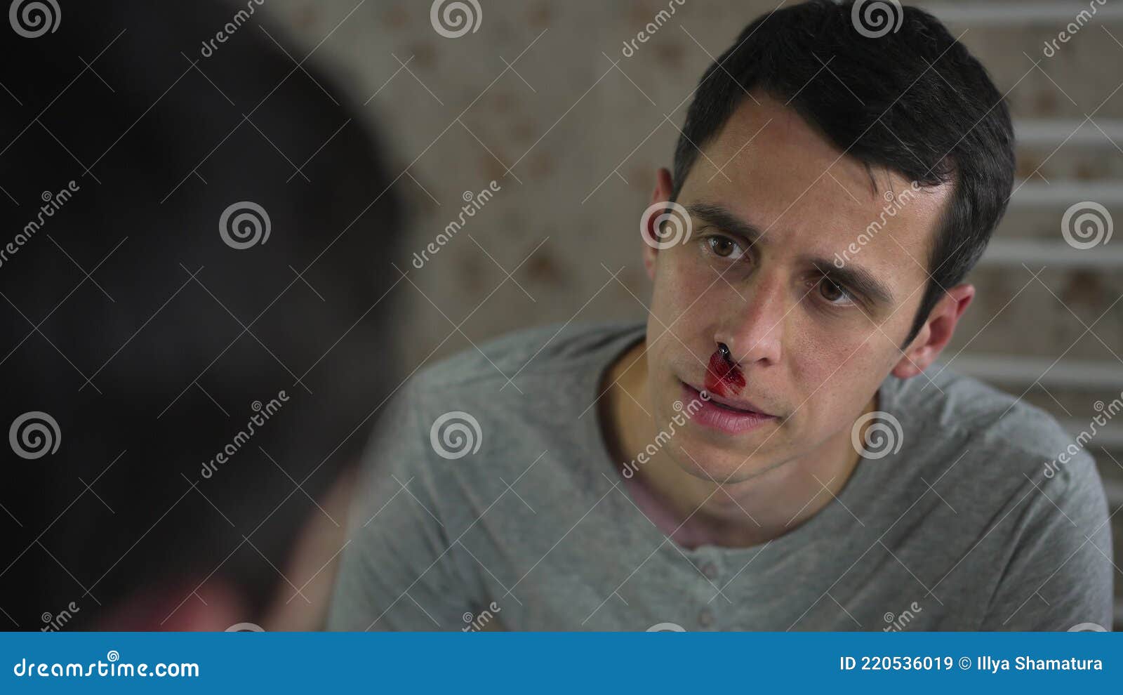 Man is Bleeding from the Nose Stock Video - Video of nosebleed, wound ...