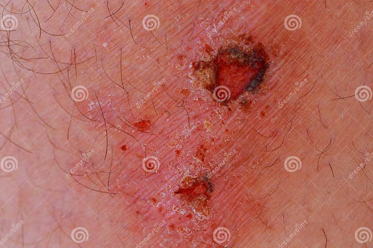 Man with a Wound on His Knee Stock Photo - Image of accident, dirt ...