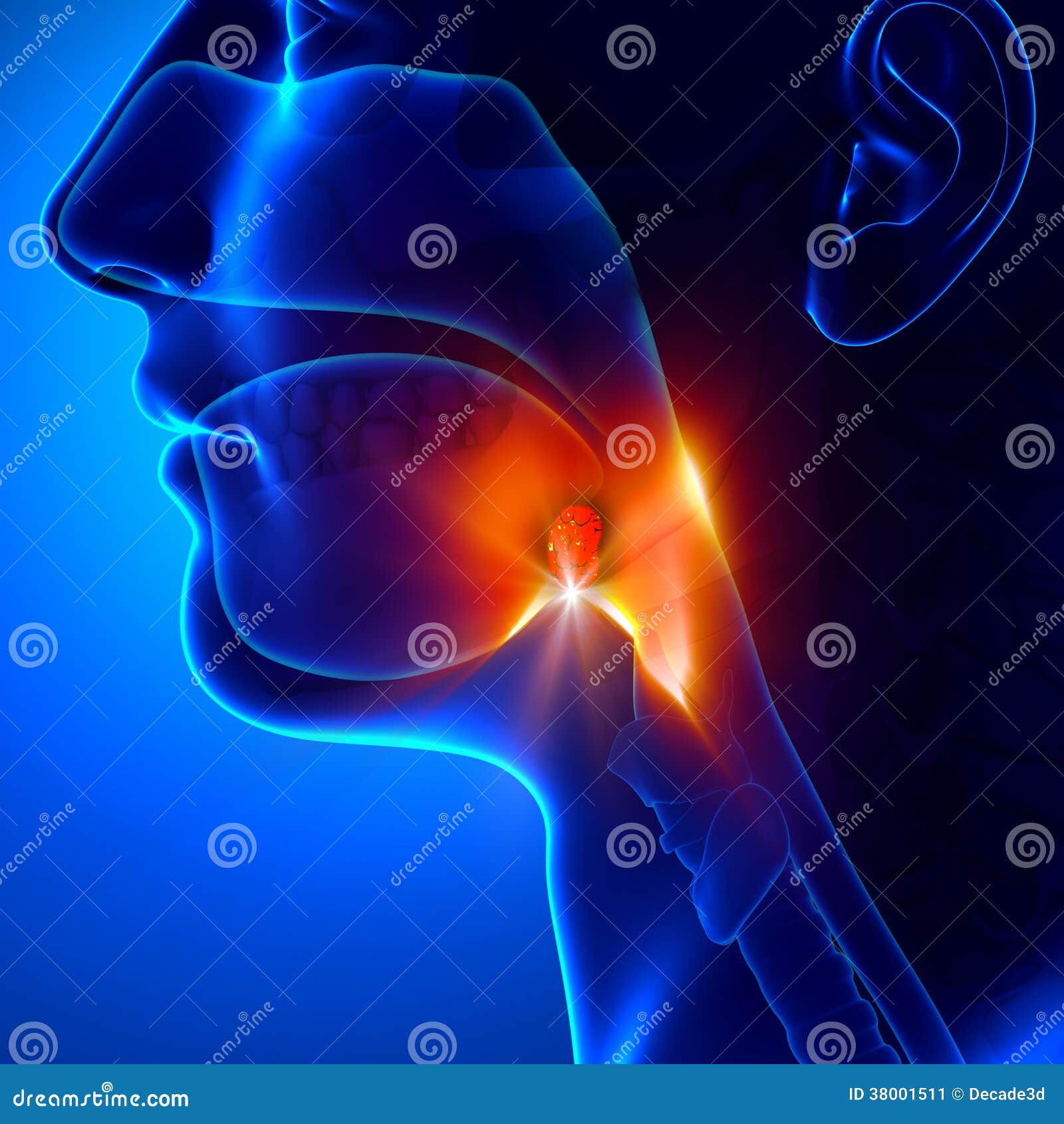Mandeln - Angina pectoris stock abbildung. Illustration von fieber ...