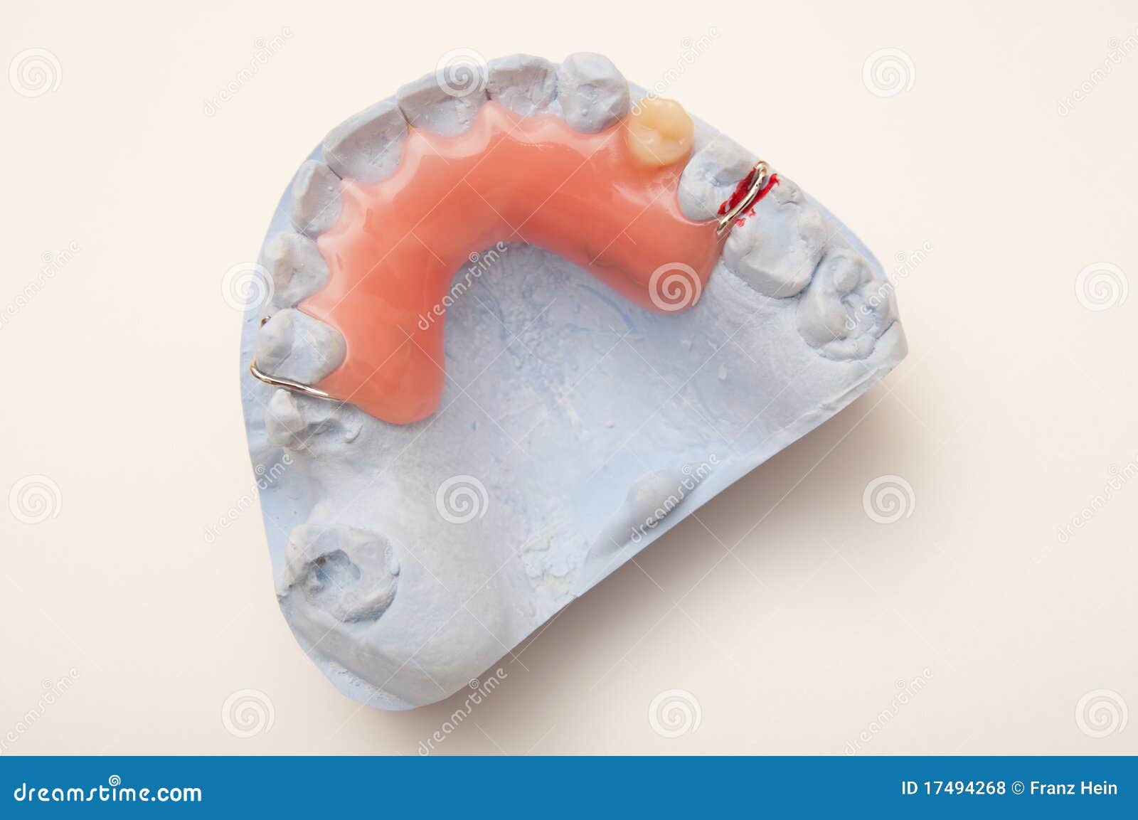 Mandible model stock photo. Image of modeled, dental - 17494268
