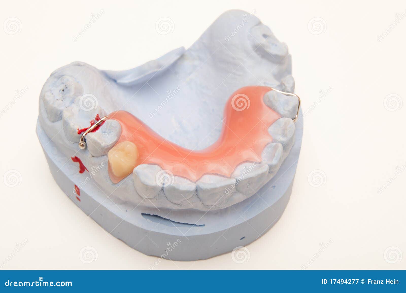 Mandible model stock image. Image of medicine, teeth - 17494277