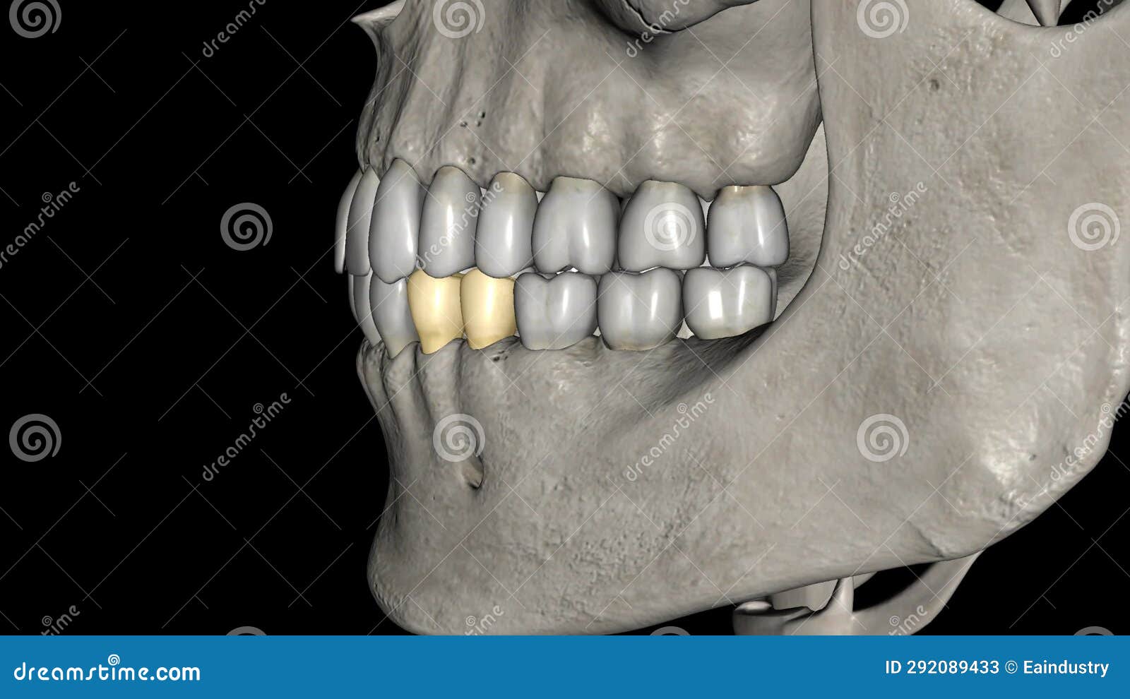 The Mandibular First Premolar is the Tooth Located Laterally from Both ...