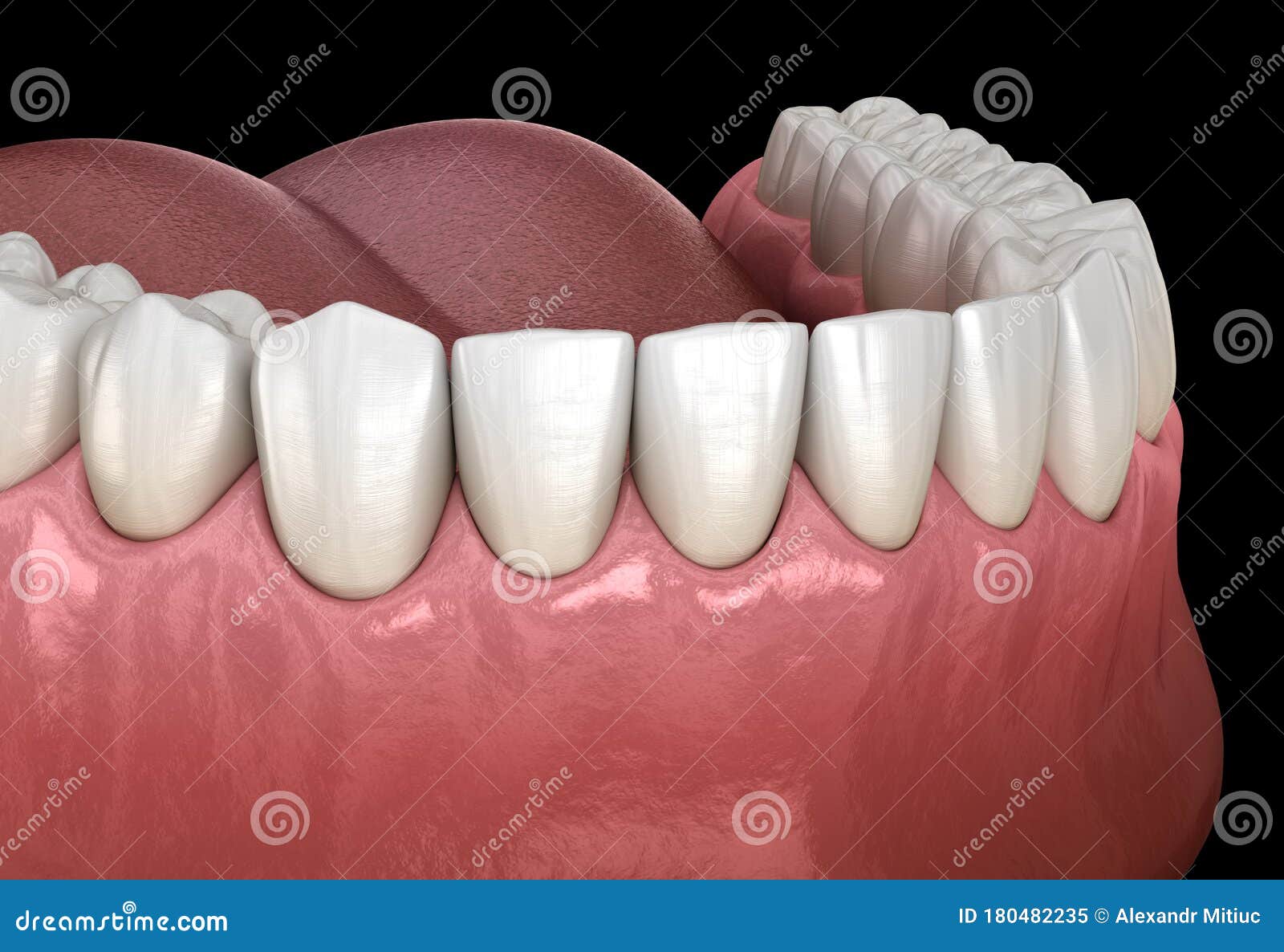 Mandibular Human Gum and Teeth. Medically Accurate Tooth Illustration ...