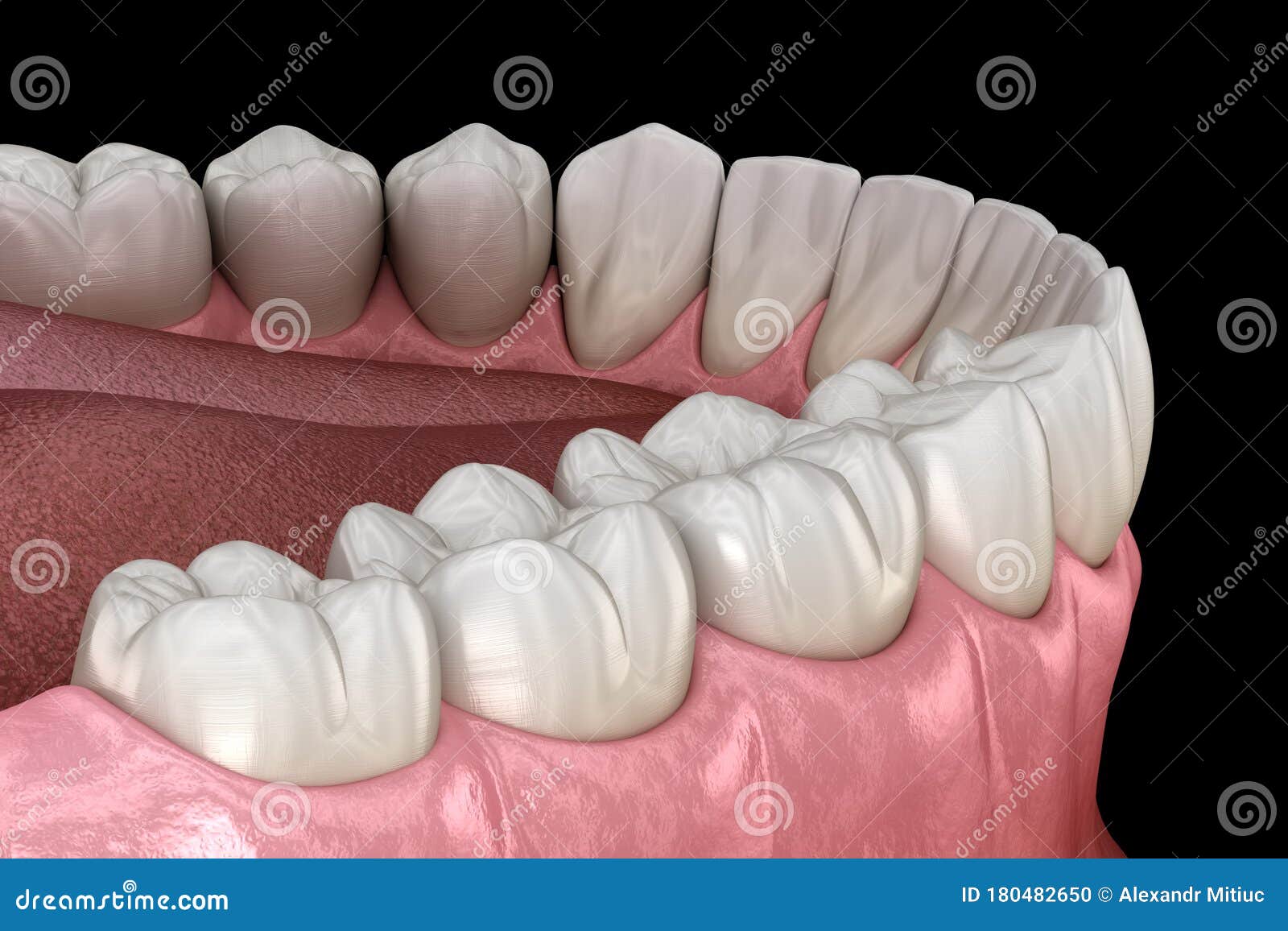 Mandibular Human Gum and Teeth. Medically Accurate Tooth Illustration ...